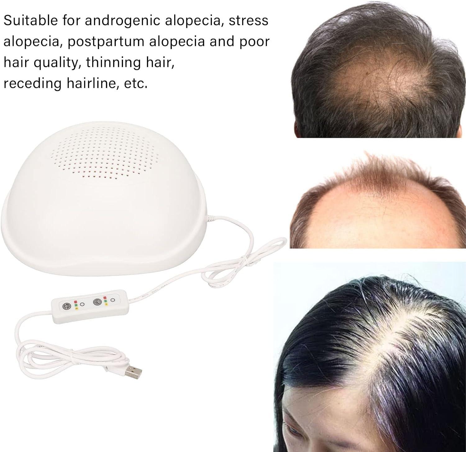LED Hair Growth Helmet for Men and Women - Hair Regrowth Treatment ...