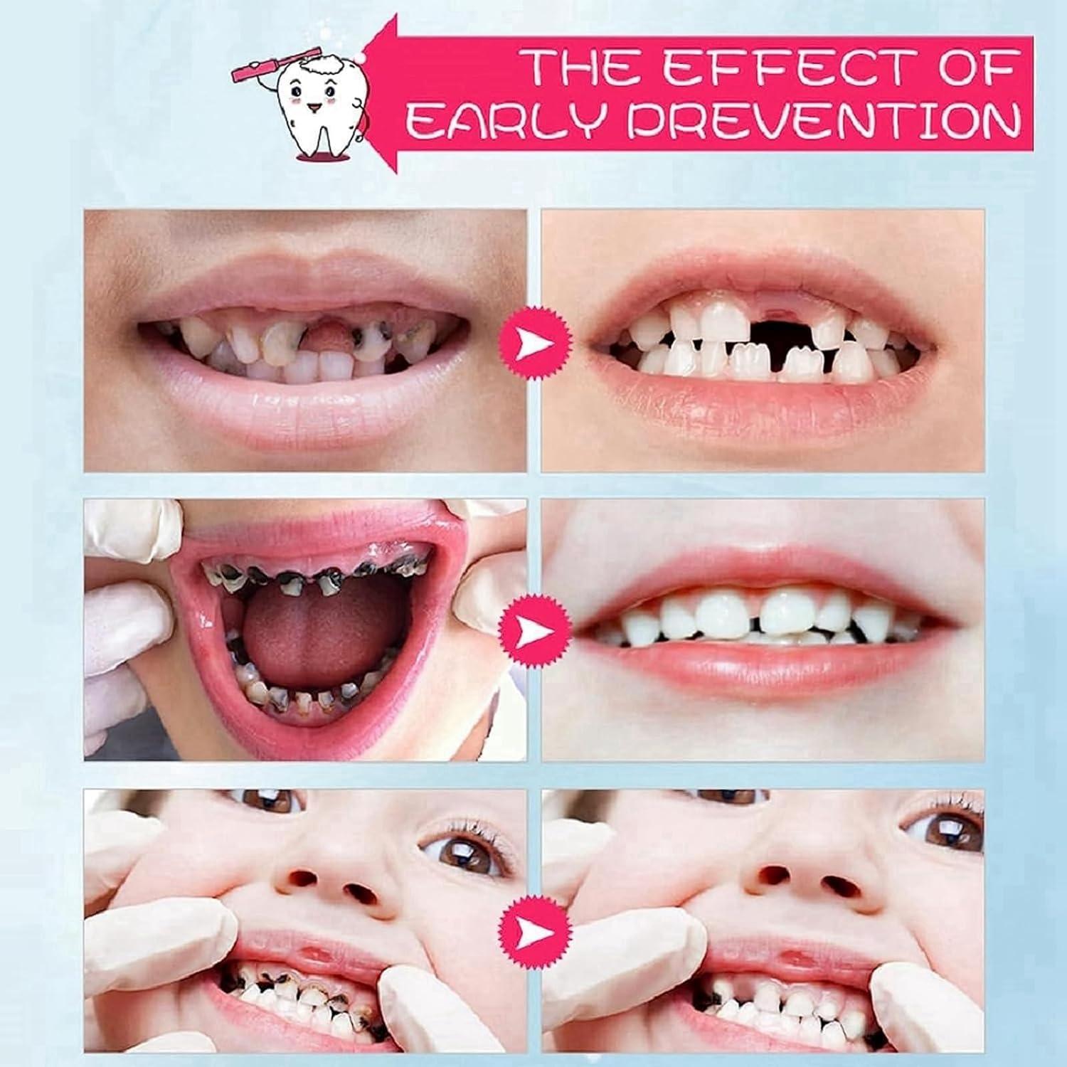 2PCS Kids Foam Toothpaste Set for U Shaped Toothbrush - Strawberry ...