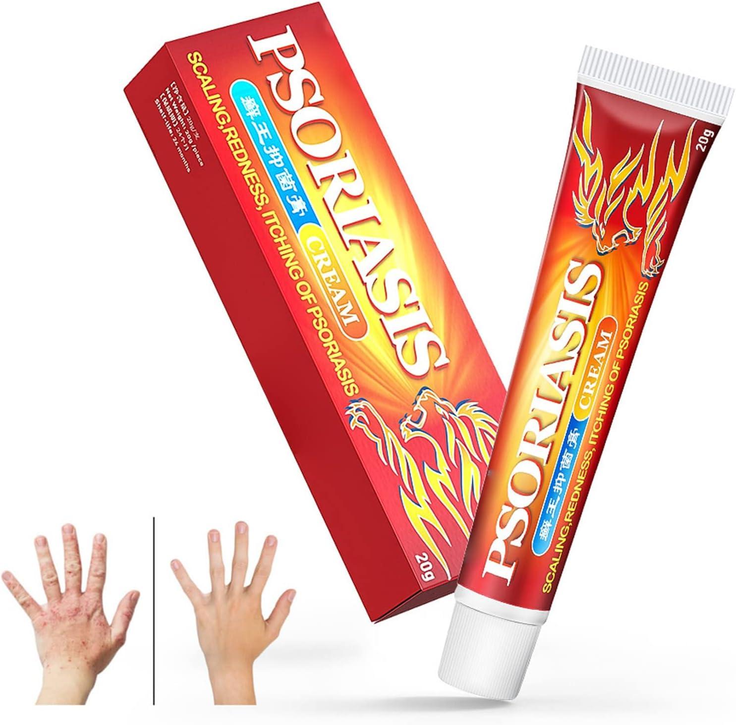 Skin Soothing Cream for Dry, Itchy & Irritated Skin - 20g | Buy Now ...