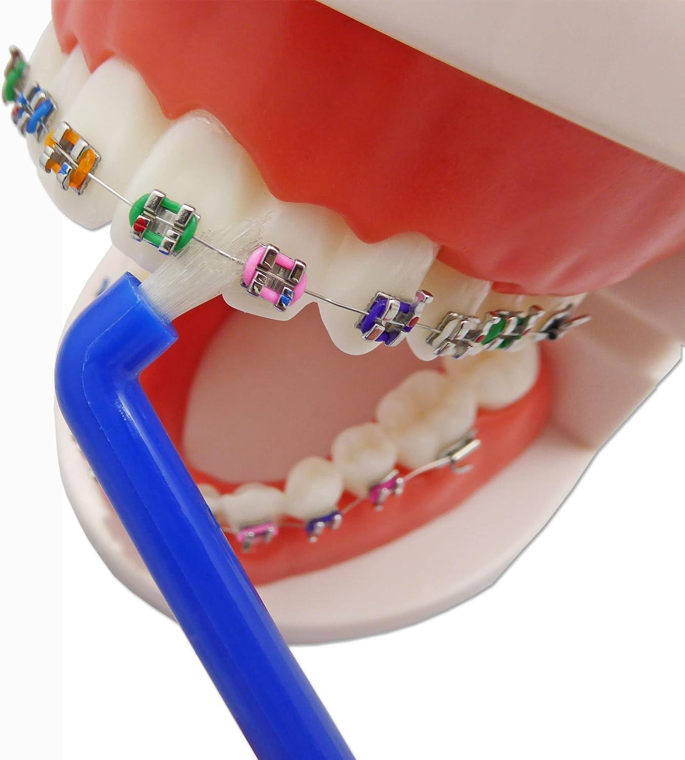 2 x Slim InterSpace Blue Toothbrushes for Orthodontic Braces & Bridges ...