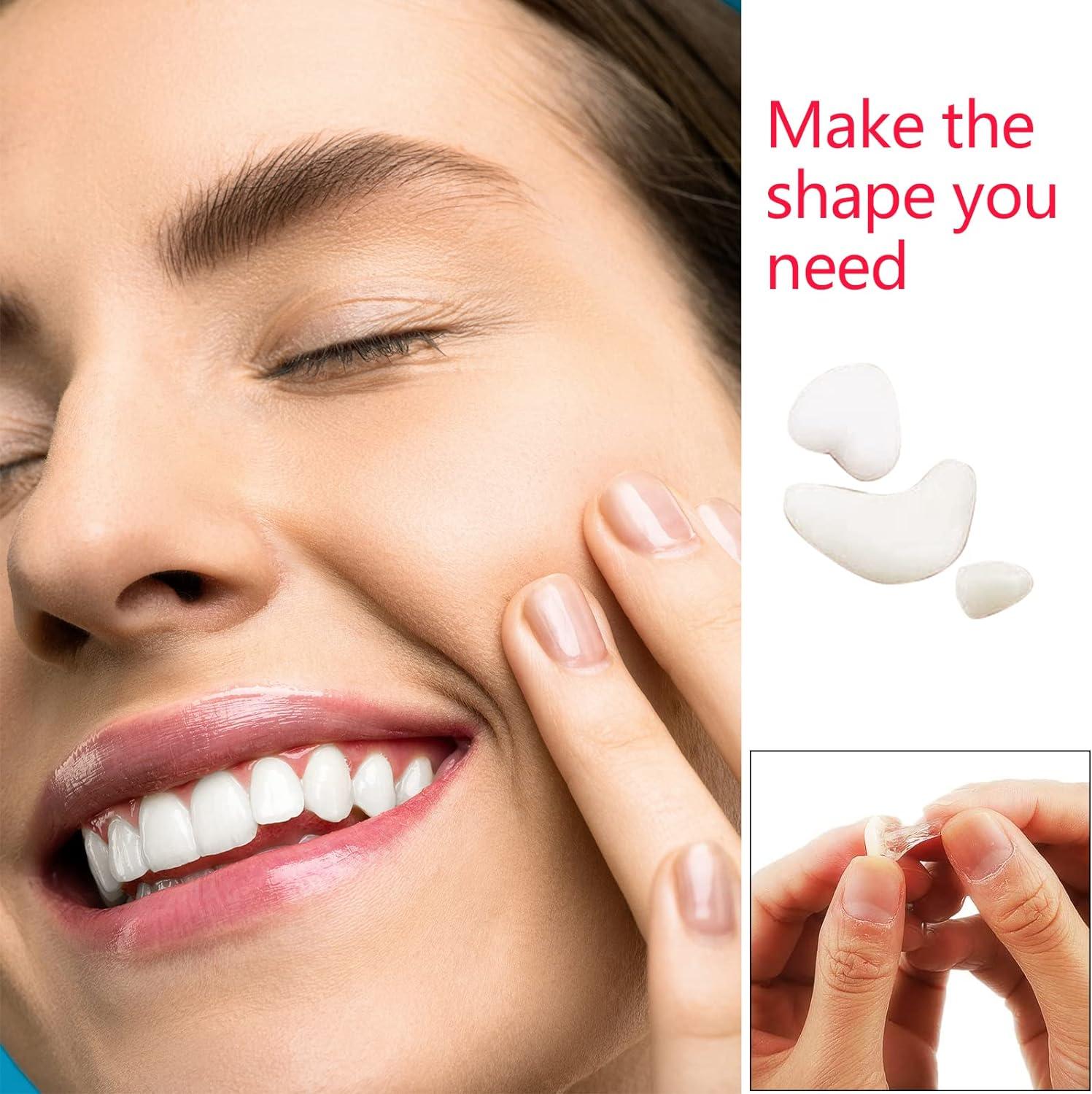 100g Temporary Tooth Repair Beads - Dental Filling Material for Missing ...