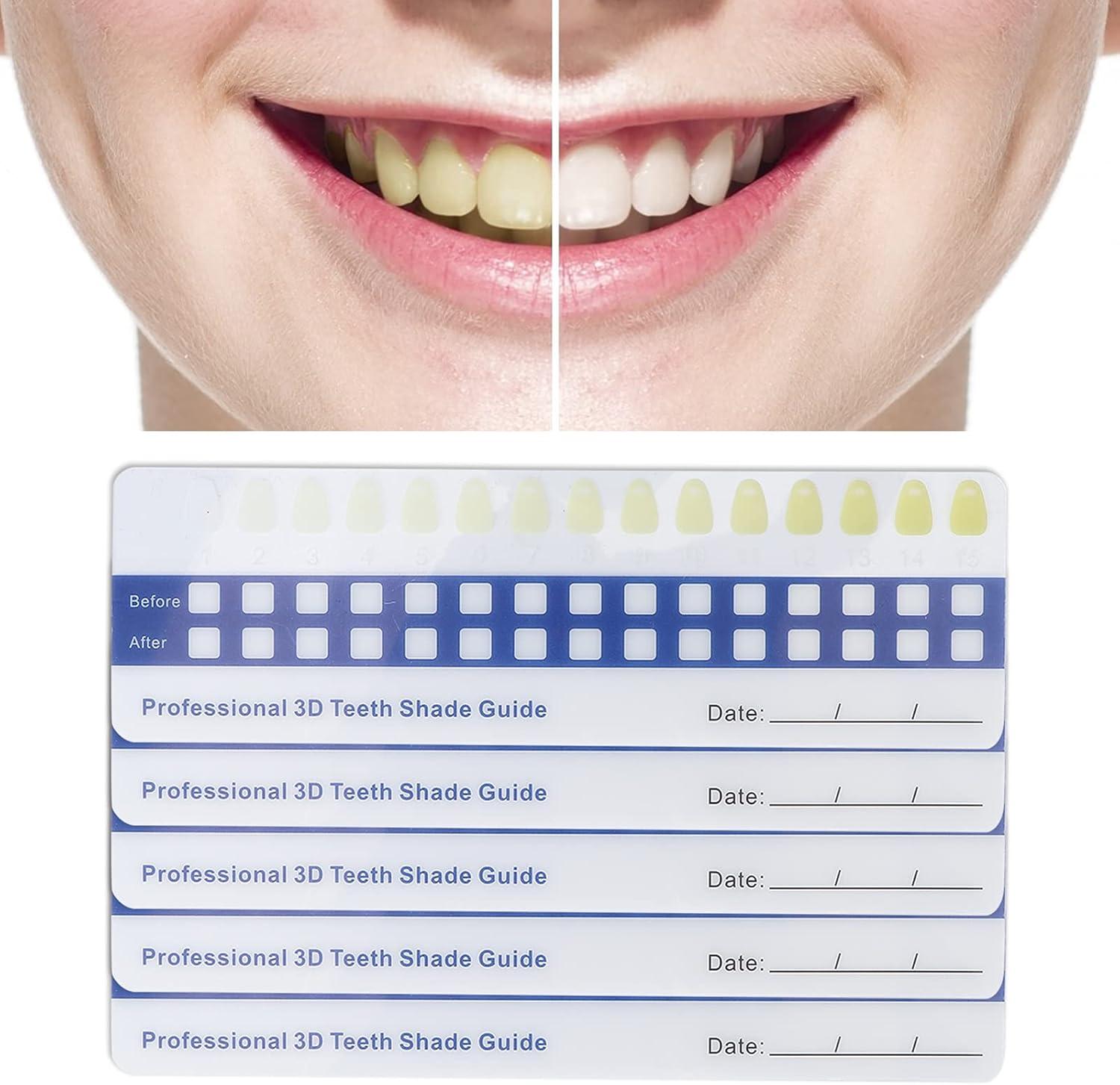 Tooth Color Chart - 5pcs Teeth Whitening Guide | Dental Care Comparison ...