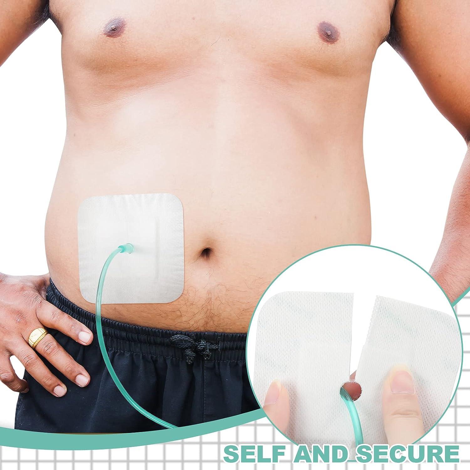 50 Pcs Feeding Tube Pads 4x4 inch - Adhesive Bandages for PD Catheter G ...