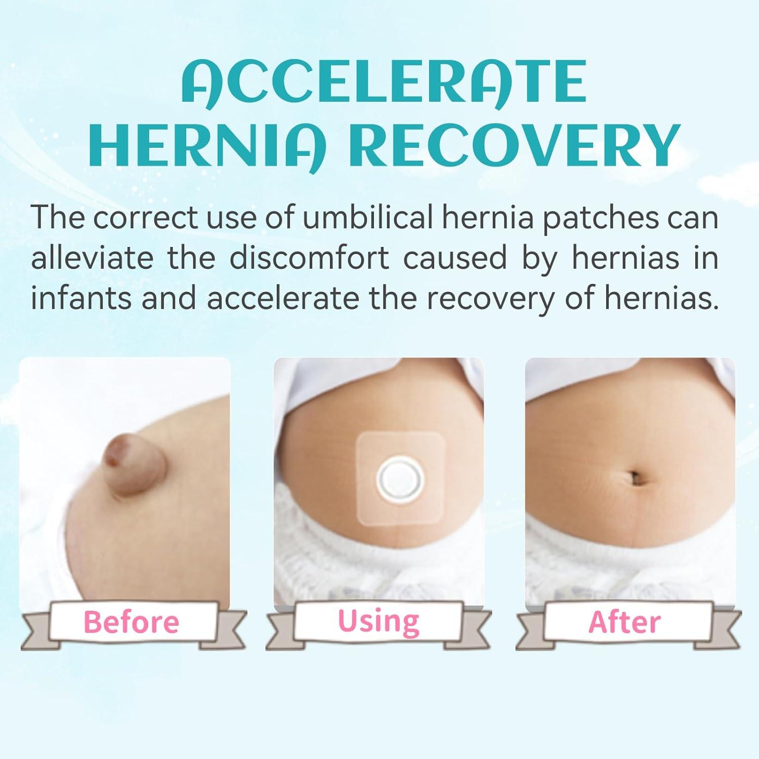 Buy Baby Belly Navel Patches - 15 Pieces Waterproof Cotton Pads for ...