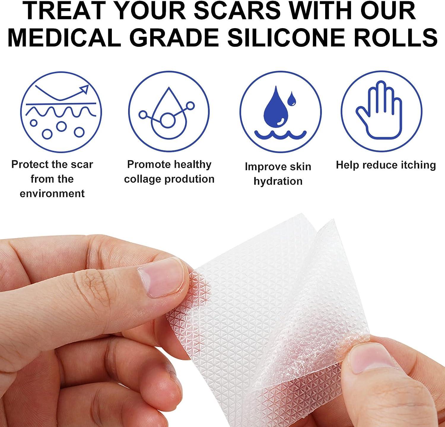3 Meter Silicone Scar Tape Gel Repair Sticker for Scalds, Burns, and ...