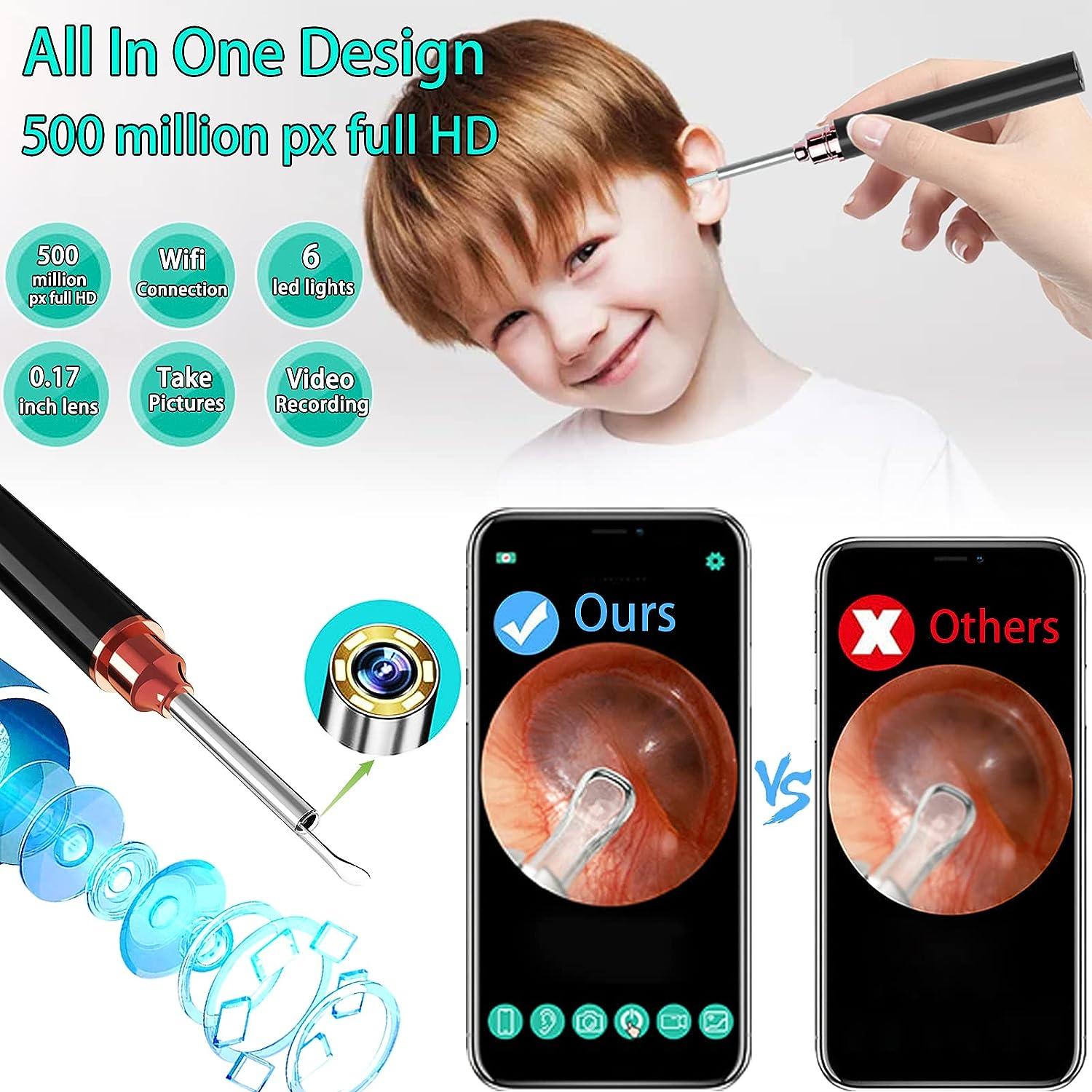 500MP Full HD Wireless Ear Wax Removal Camera | Ear Cleaner Endoscope ...
