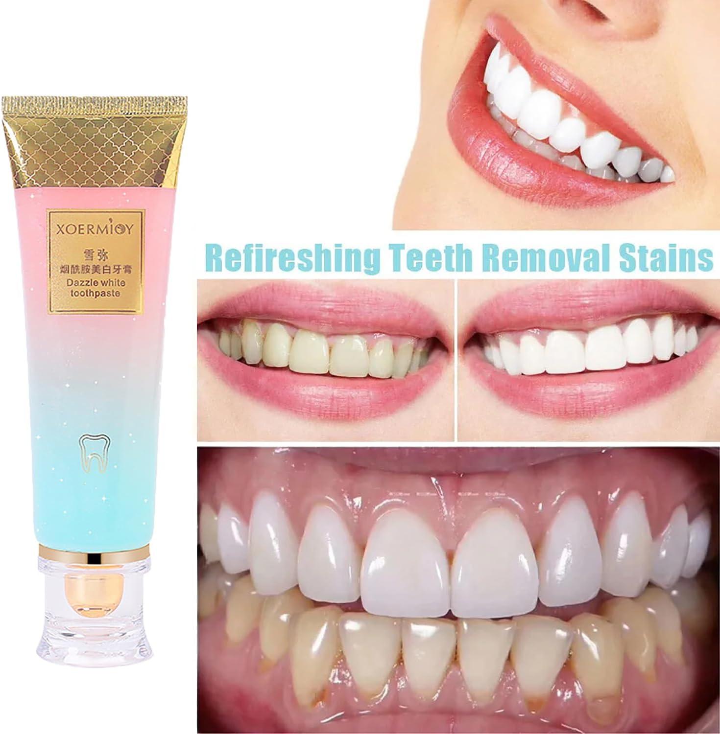 Body Accel Nicotinamide Teeth Whitening Toothpaste - 100g Dazzling ...