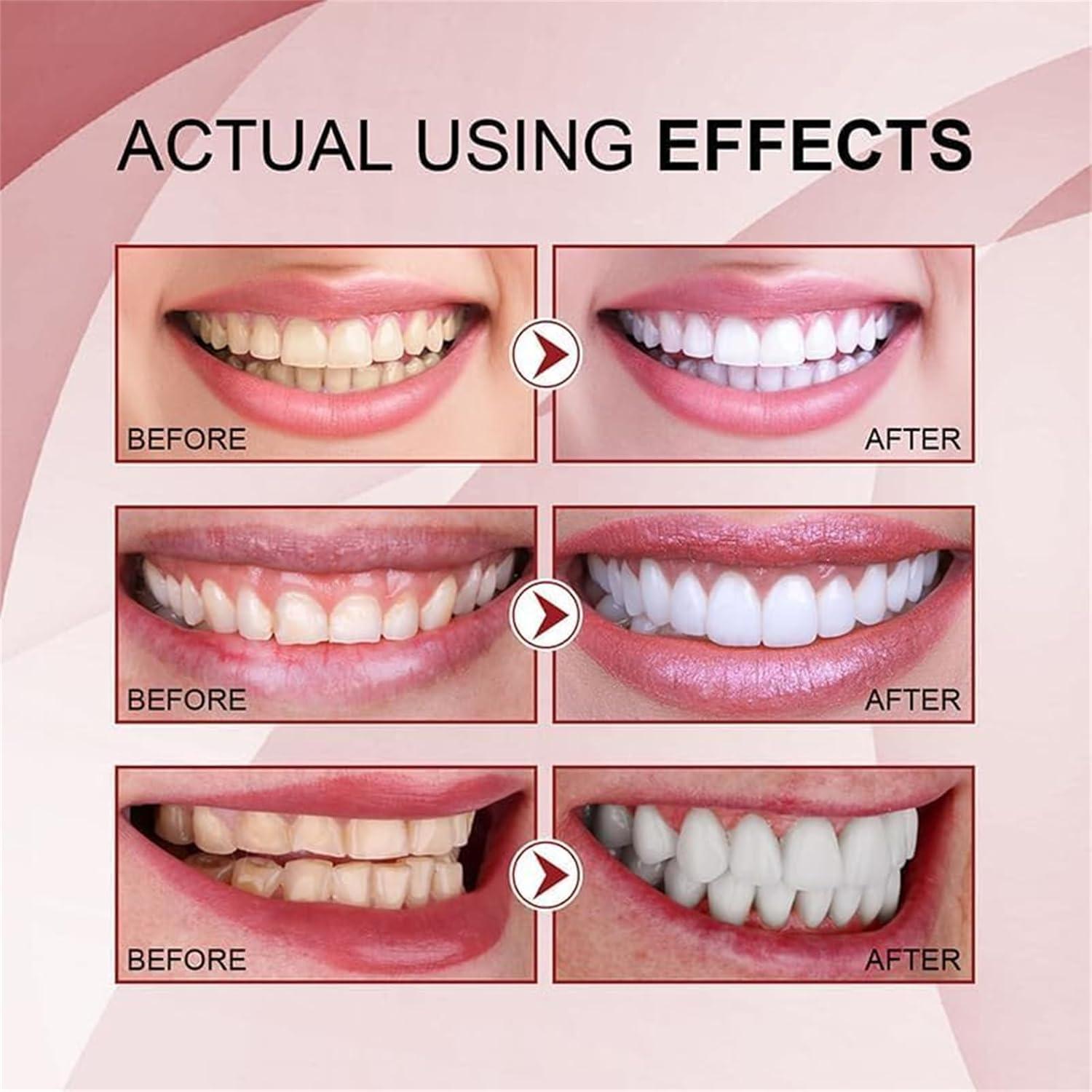 SP-4 Probiotic Ultra Whitening Toothpaste - Brighten Your Smile ...