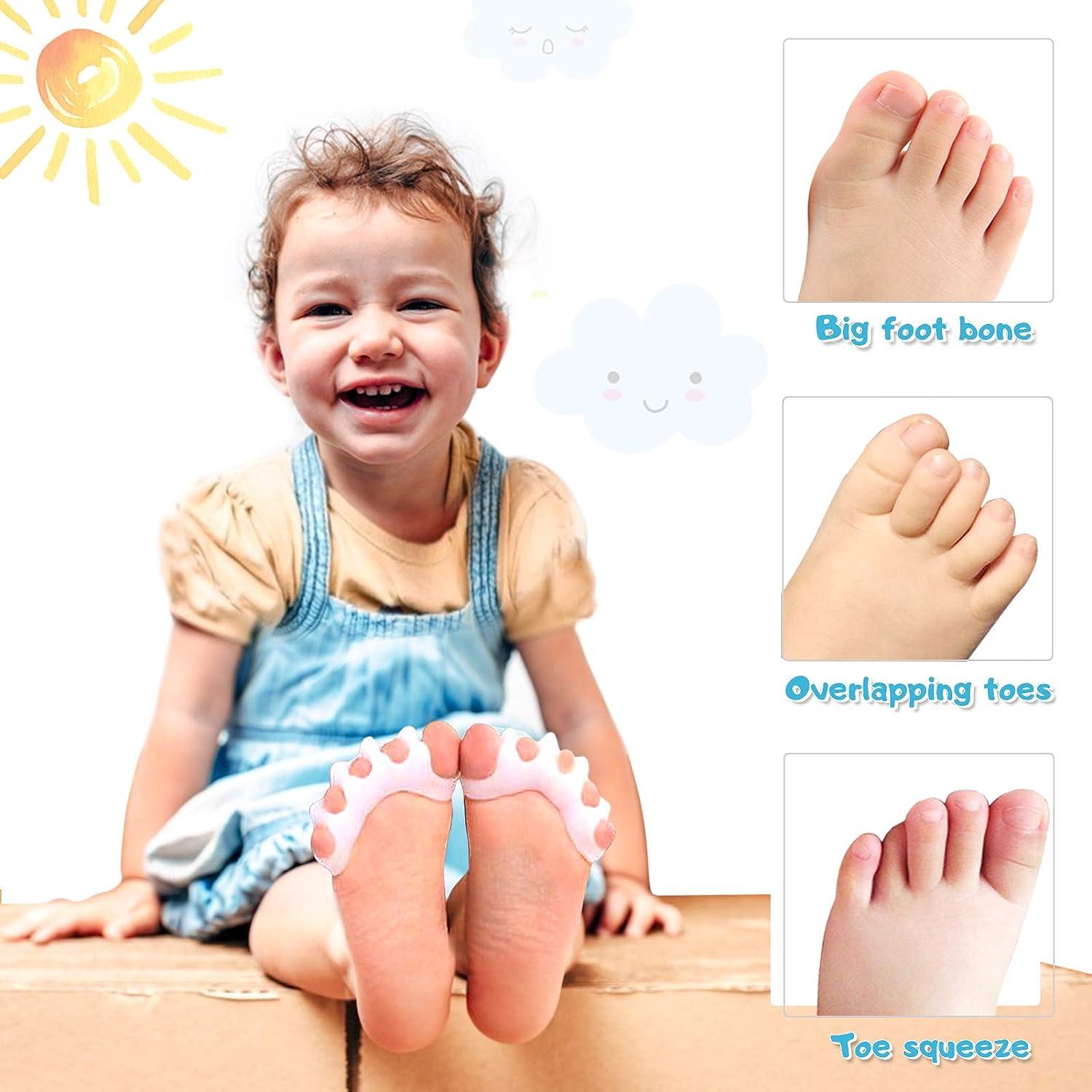 ERSANLI Children's Gel Toe Separator & Bunion Corrector - White, 2 Pcs ...