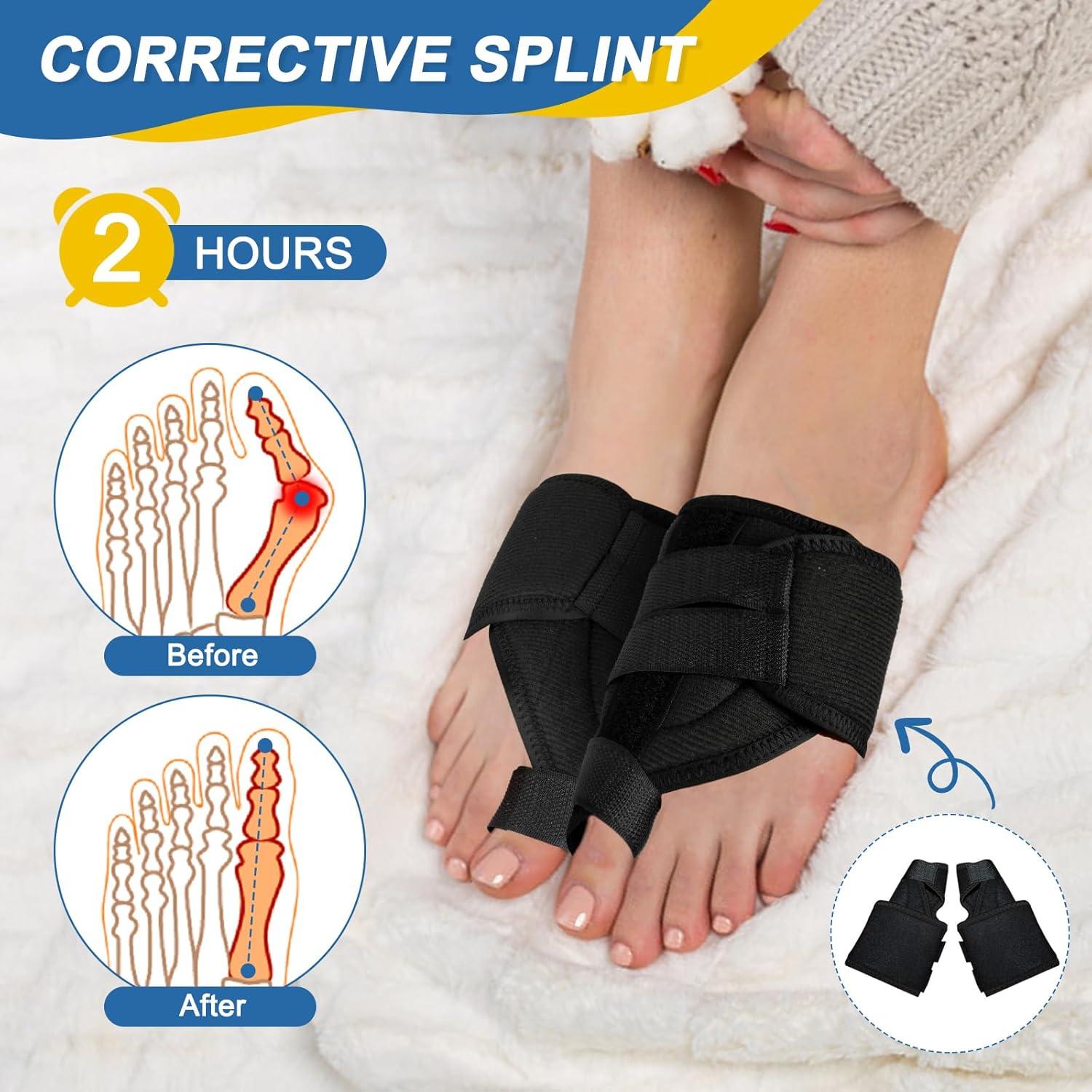Libershine Hallux Valgus Correction 6-in-1 Set | Bunion Corrector & Day ...