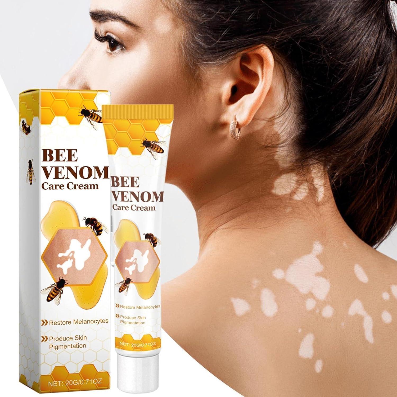 Itch Relief Cream Itch Relief Lotion Redness Relief Cream Rash Cream ...