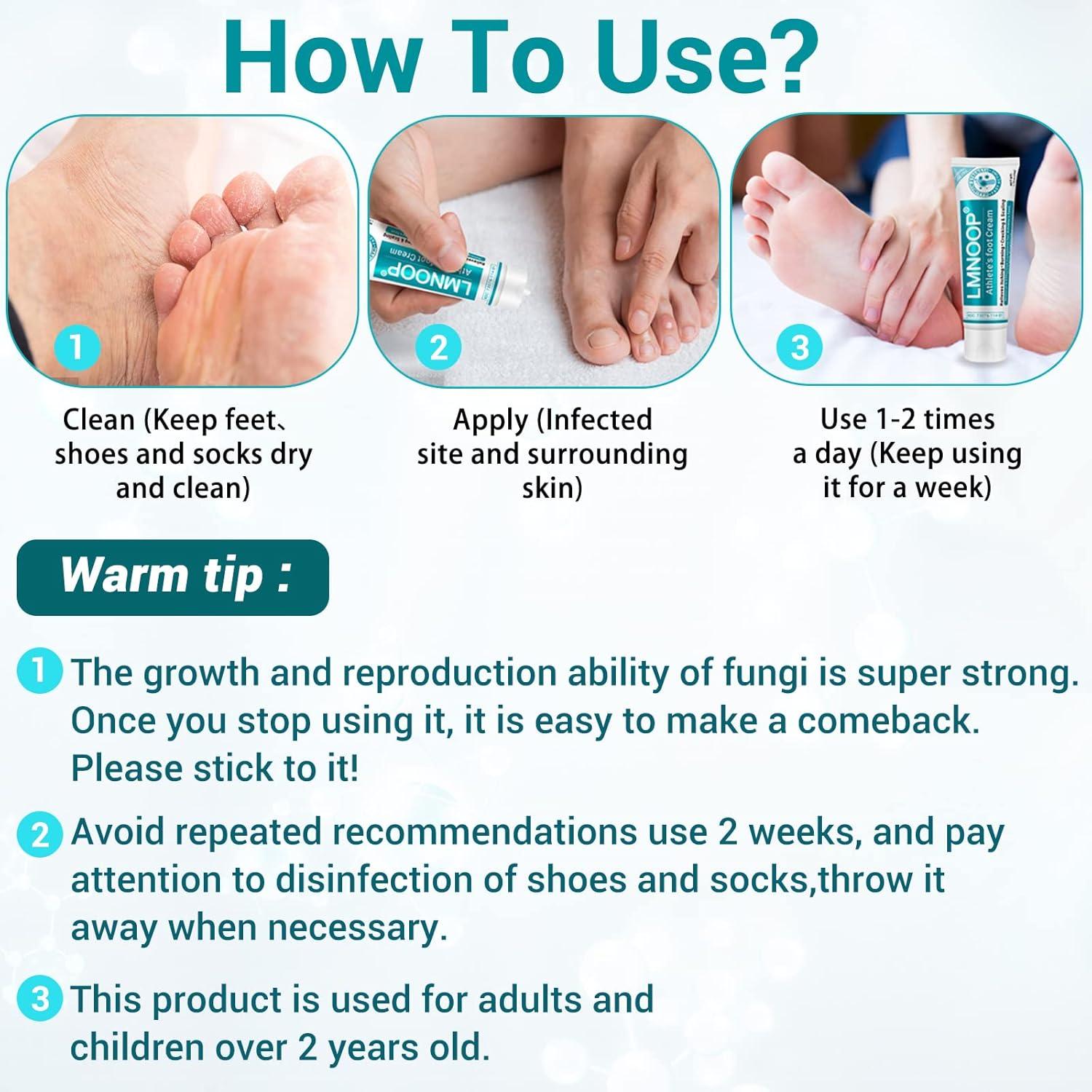 LMNOOP Maximum Strength Athlete's Foot Treatment Cream - Natural Herbal ...