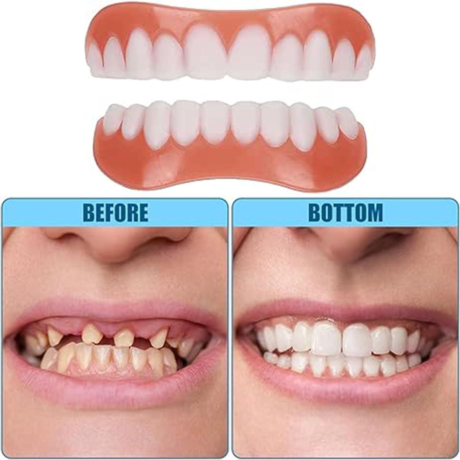 Buy Affordable Cosmetic Veneers & Temporary Dentures - International ...