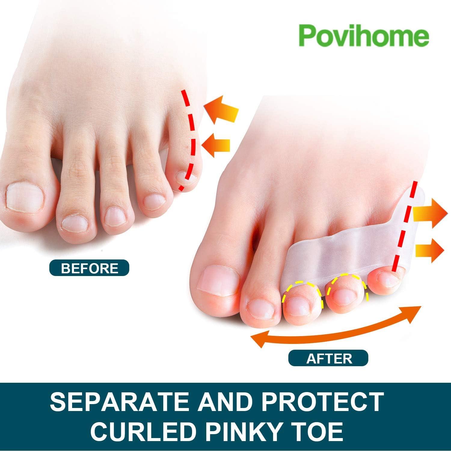 Povihome Triple Gel Pinky Toe Separators - Pack of 10 for Overlapping ...