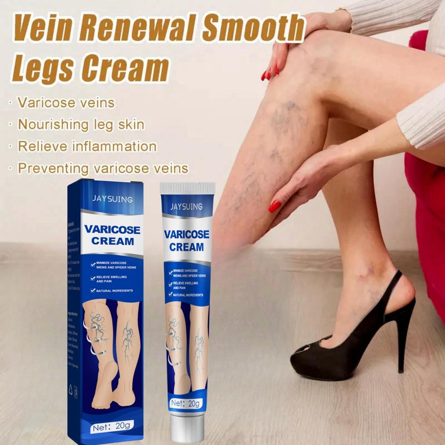 Varicose Veins Cream - Treatment for Leg Spider Vein Relief and Healing