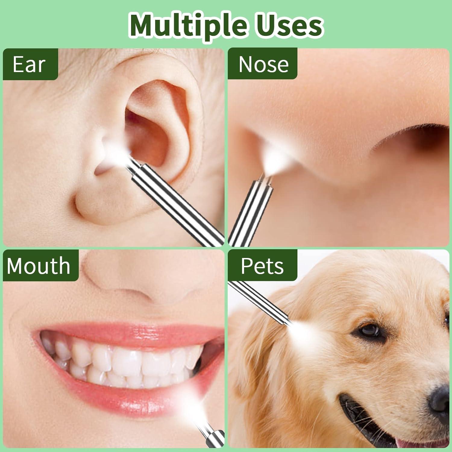 VITCOCO Ear Wax Removal Kit - 1920P HD Otoscope for iPhone & Android ...