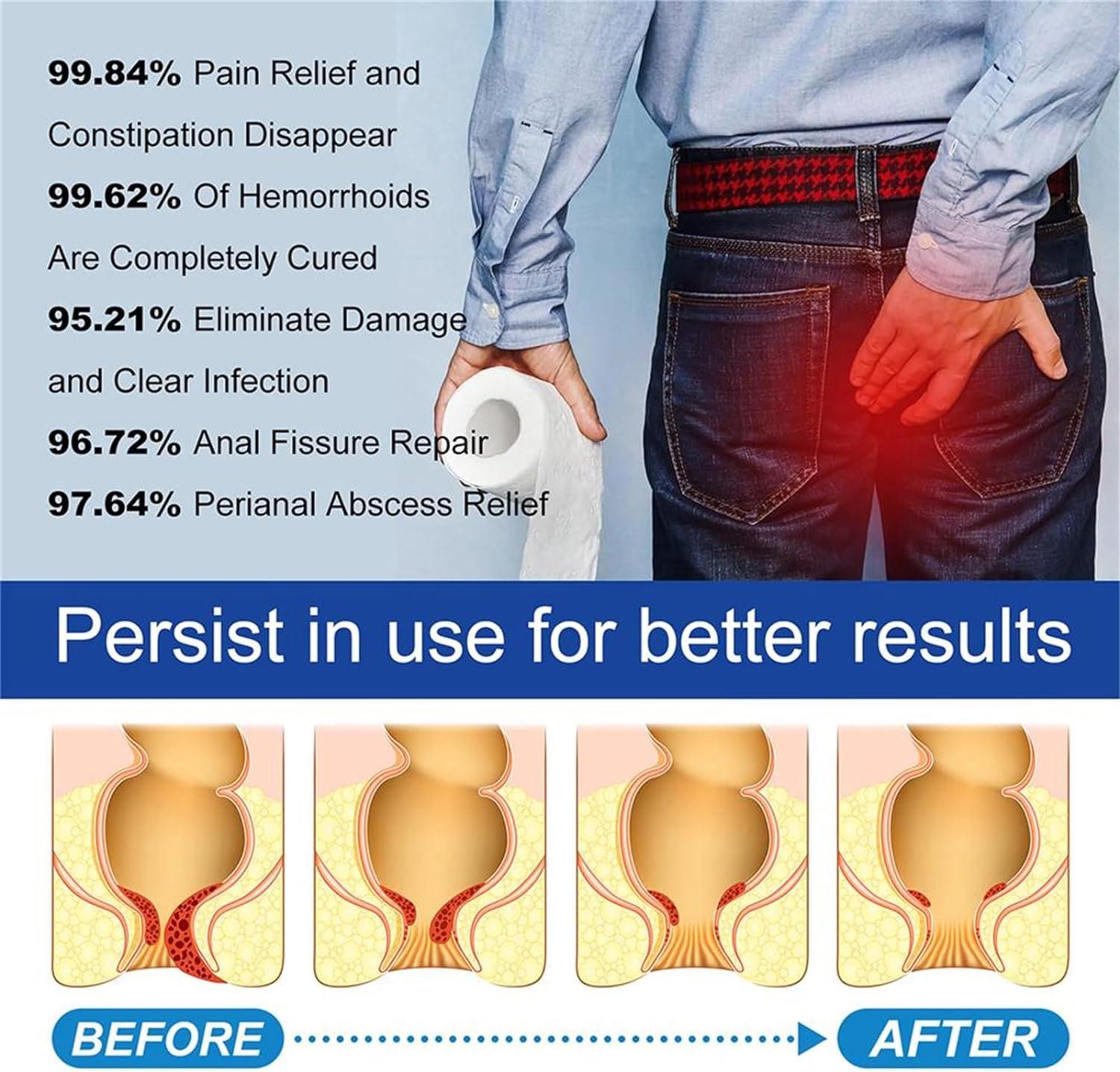 Sydry Heca Natural Herbal Hemorrhoid Relief Capsules - 1 PCS | Buy Now with Express ...