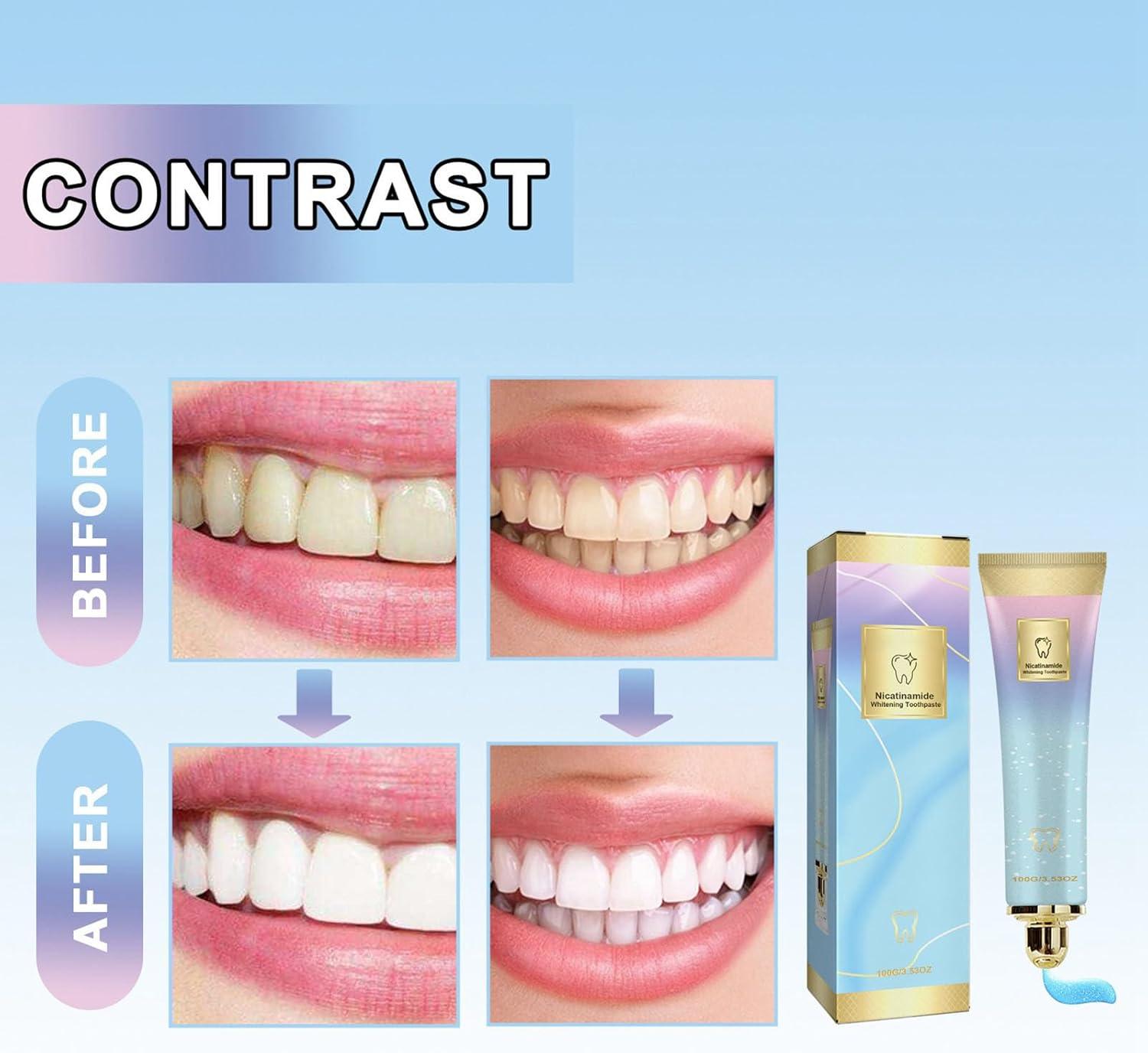 2 Pack Whitening Toothpaste - Stubborn Stain Removal for a Confident ...