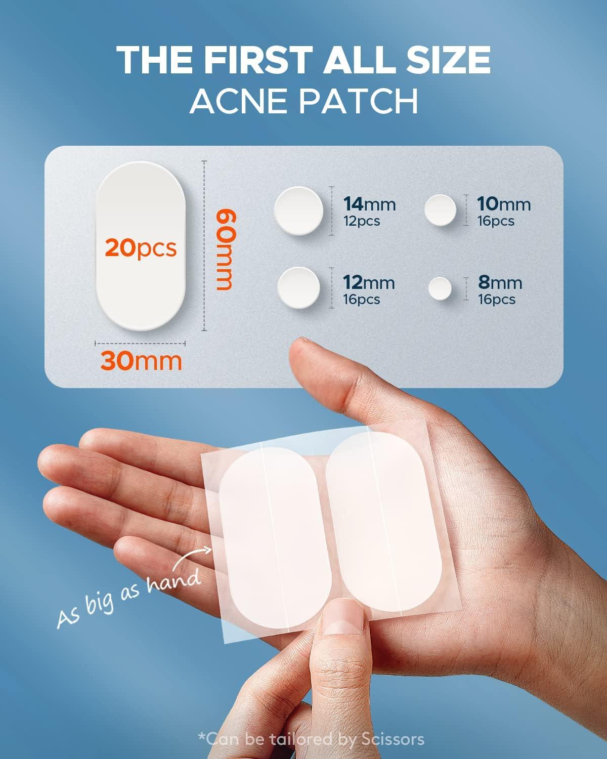 LitBear Acne Pimple Spot Patches - 80 Count Hydrocolloid Treatment for ...