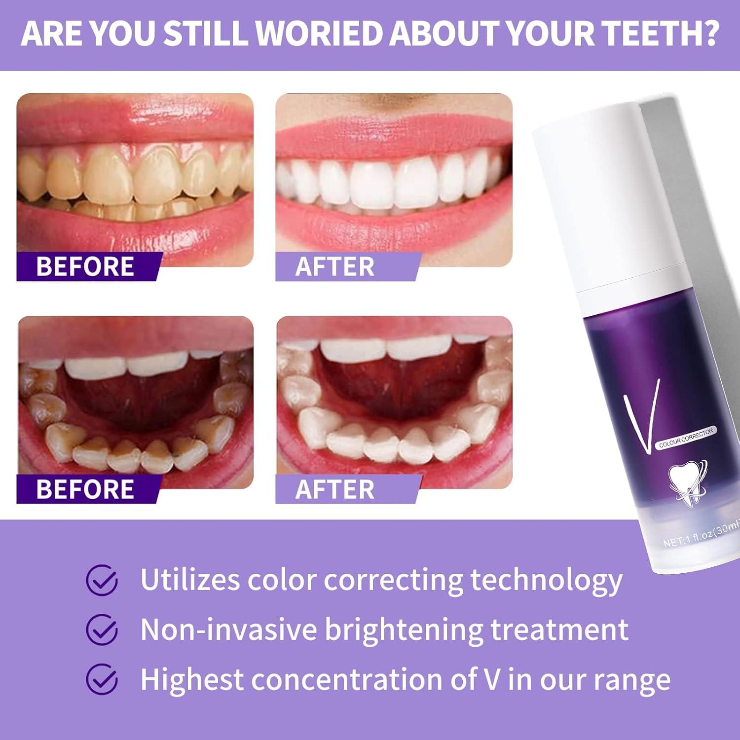 Teeth Whitening Foam Toothpaste - Intensive Stain Removal with Baking ...
