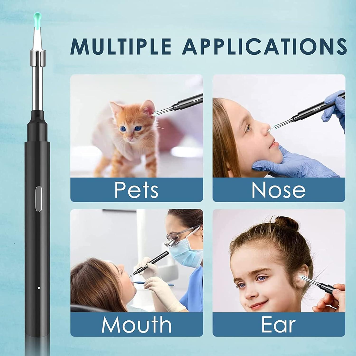 Zupora Ear Camera 1920P FHD Wireless Otoscope with LED Lights - Ear Wax ...