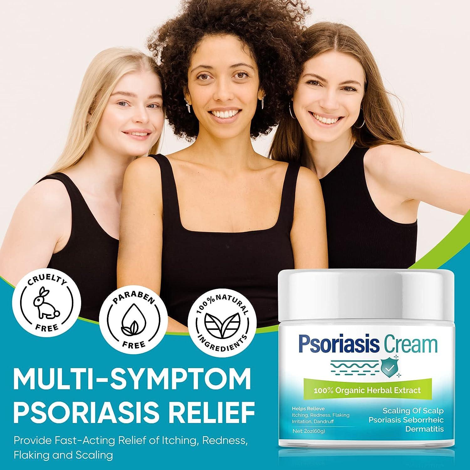 Topicy Psoriasis Cream | Seborrheic Dermatitis Treatment | Effective ...