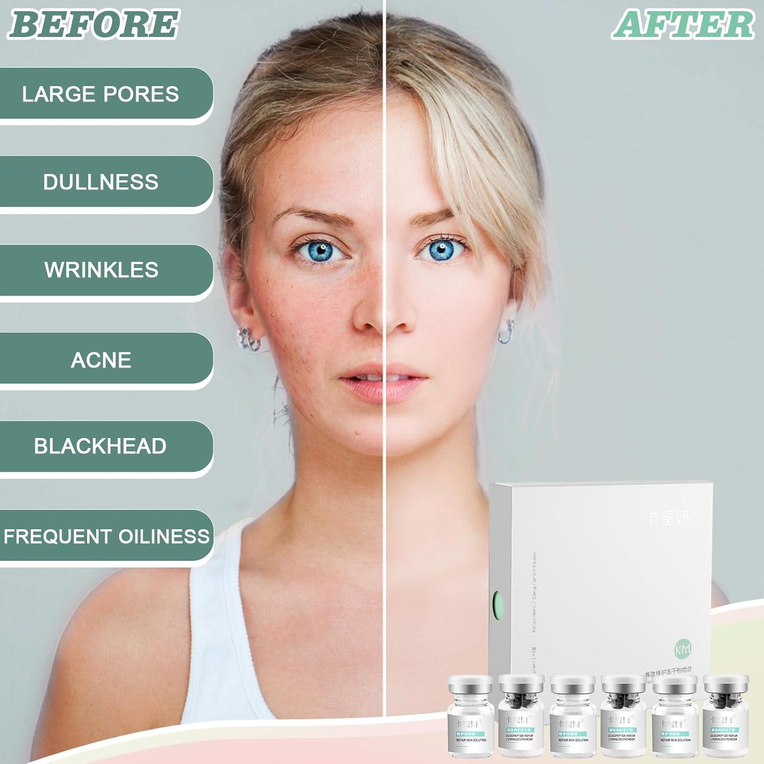 Collagen Oligopeptide Repairing Serum Set | Instant Face & Eye Lift ...