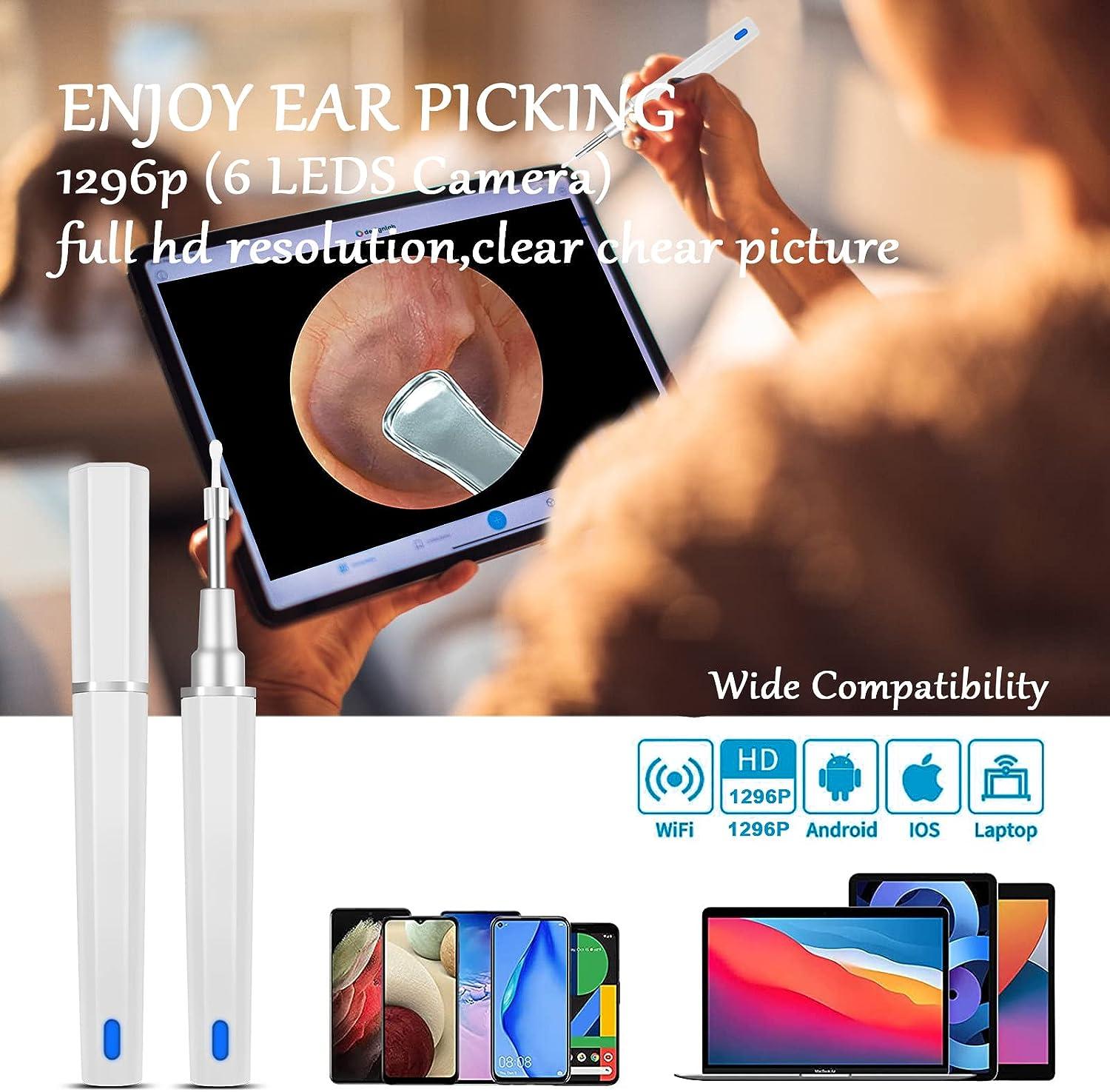 1296P HD Ear Wax Removal Tool with Light & Camera - Earwax Removal Kit ...