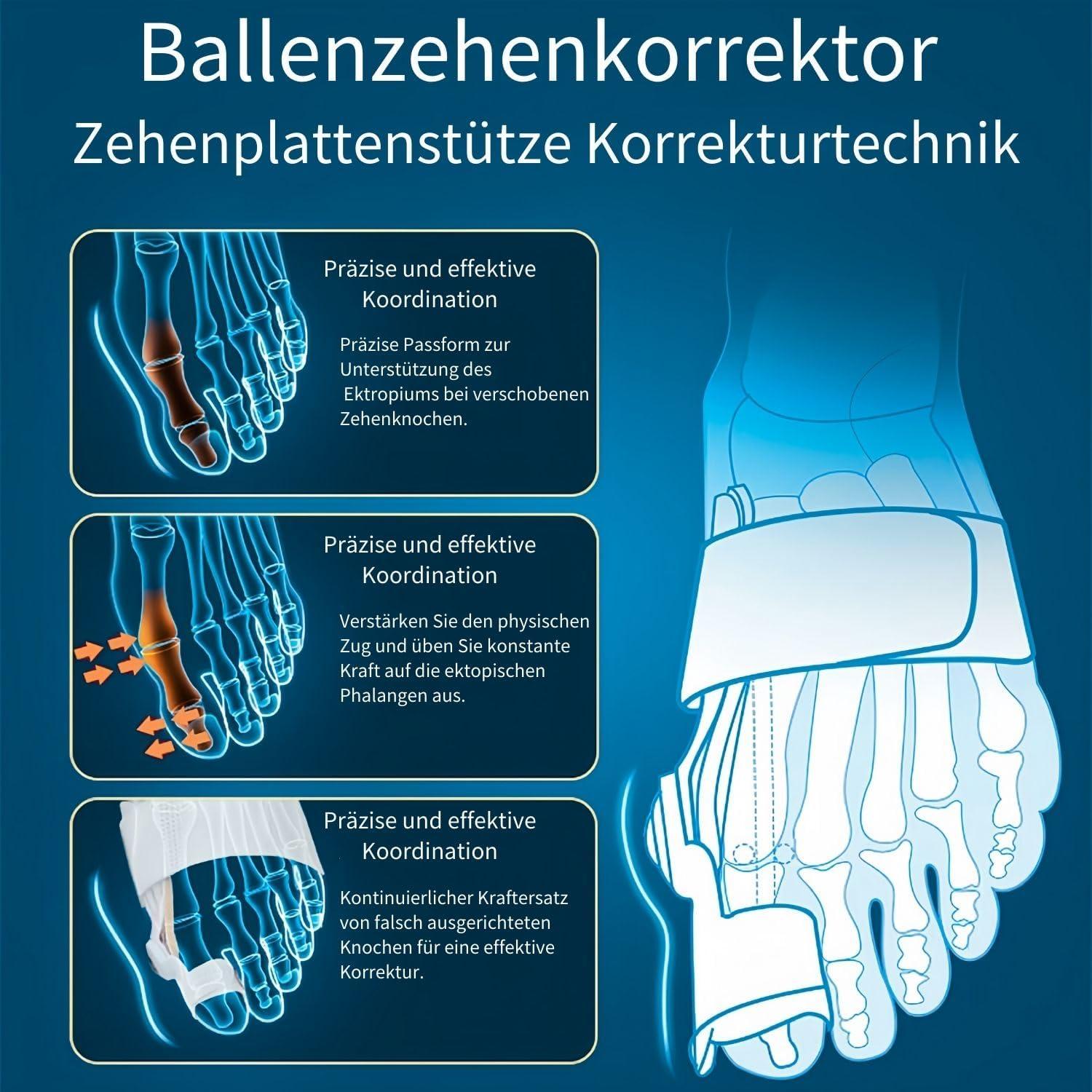 Melarqt Hallux Valgus Correction - Adjustable Toe Spreader & Rail for ...