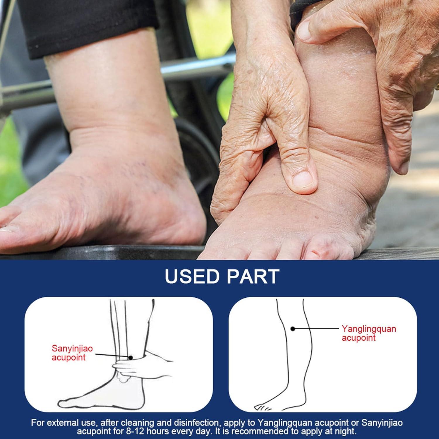 Bone Edema Relief Plasters - 50 Herbal Extract Pieces for Circulatory ...