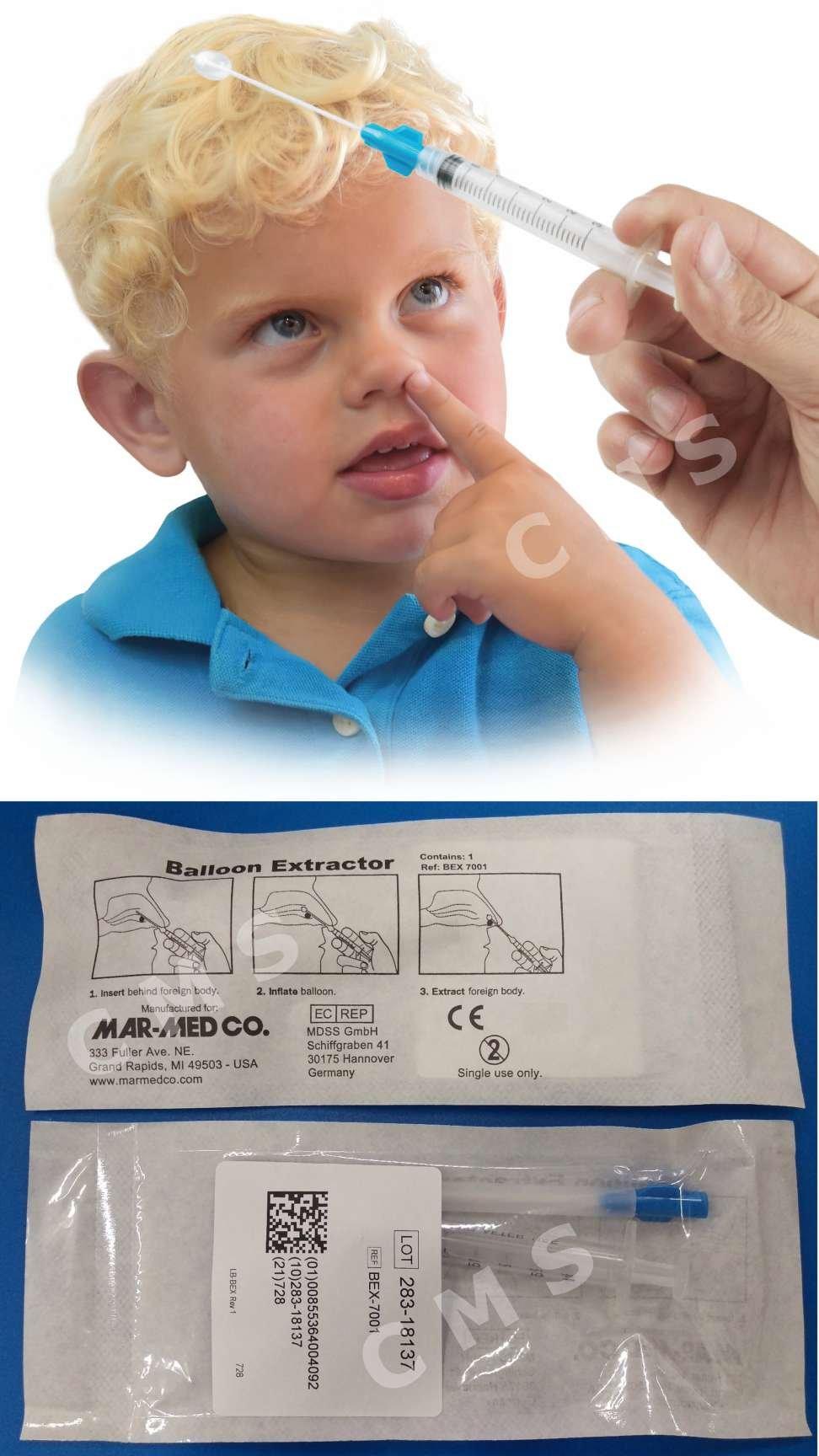 MAR-MED Balloon Extractor for Nasal Foreign Body Removal - BEX-7001 ...