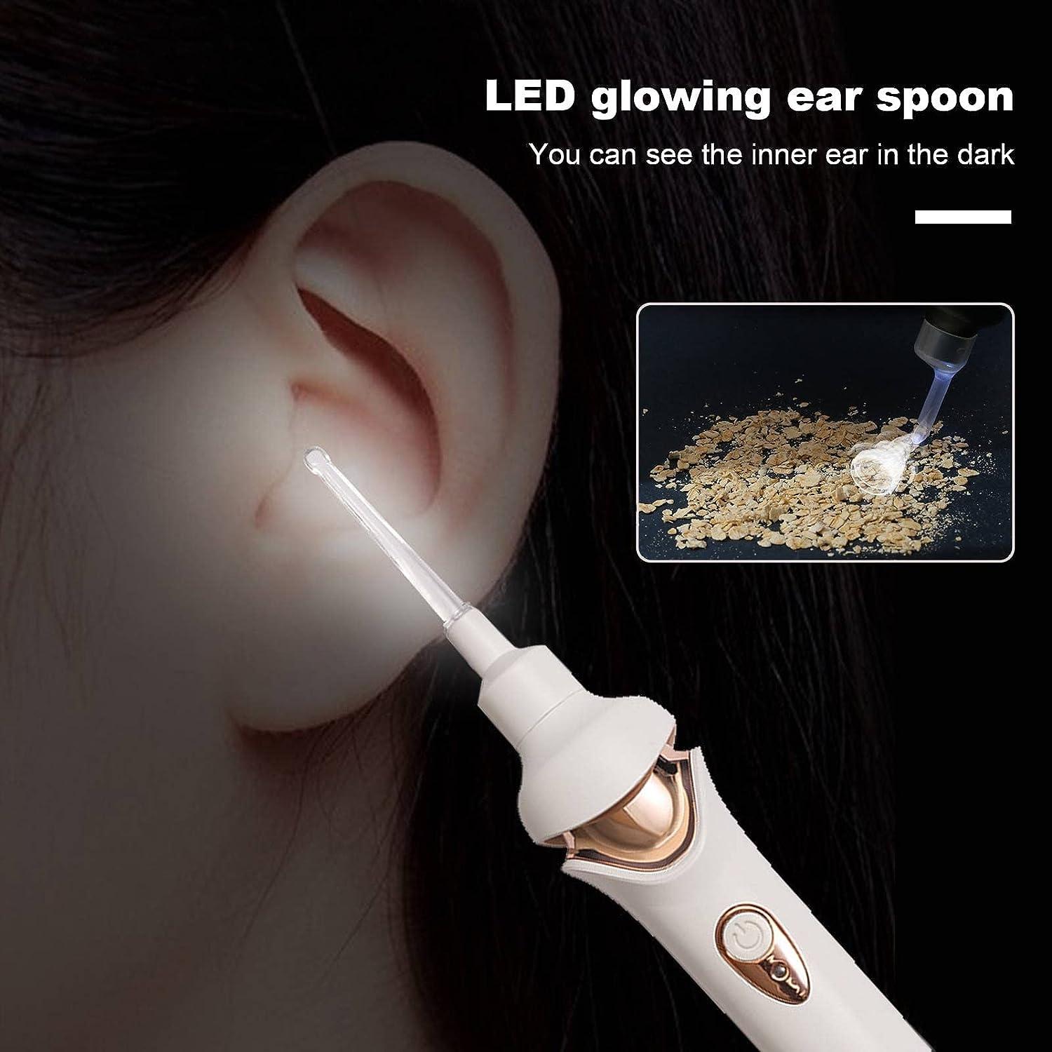 LED Ear Wax Removal Kit | Safe & Soft Ear Cleaning Tool for Adults ...