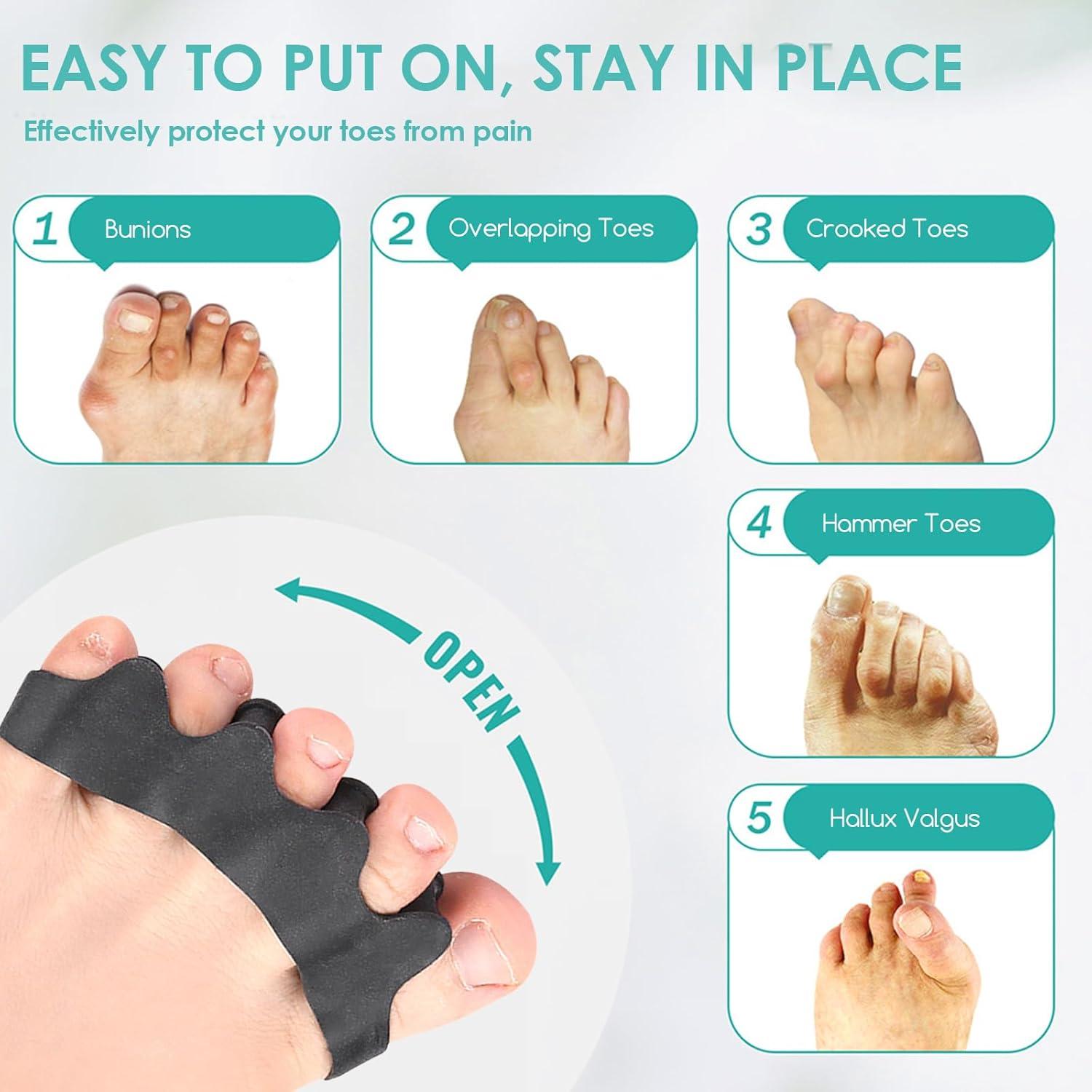 Toe Spreader Silicone (2 Pairs) & Hallux Valgus Relief | Overlapping ...