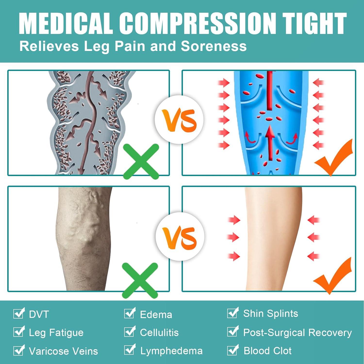 Evolyline Medical Compression Pantyhose for Women & Men 20-30mmHg ...