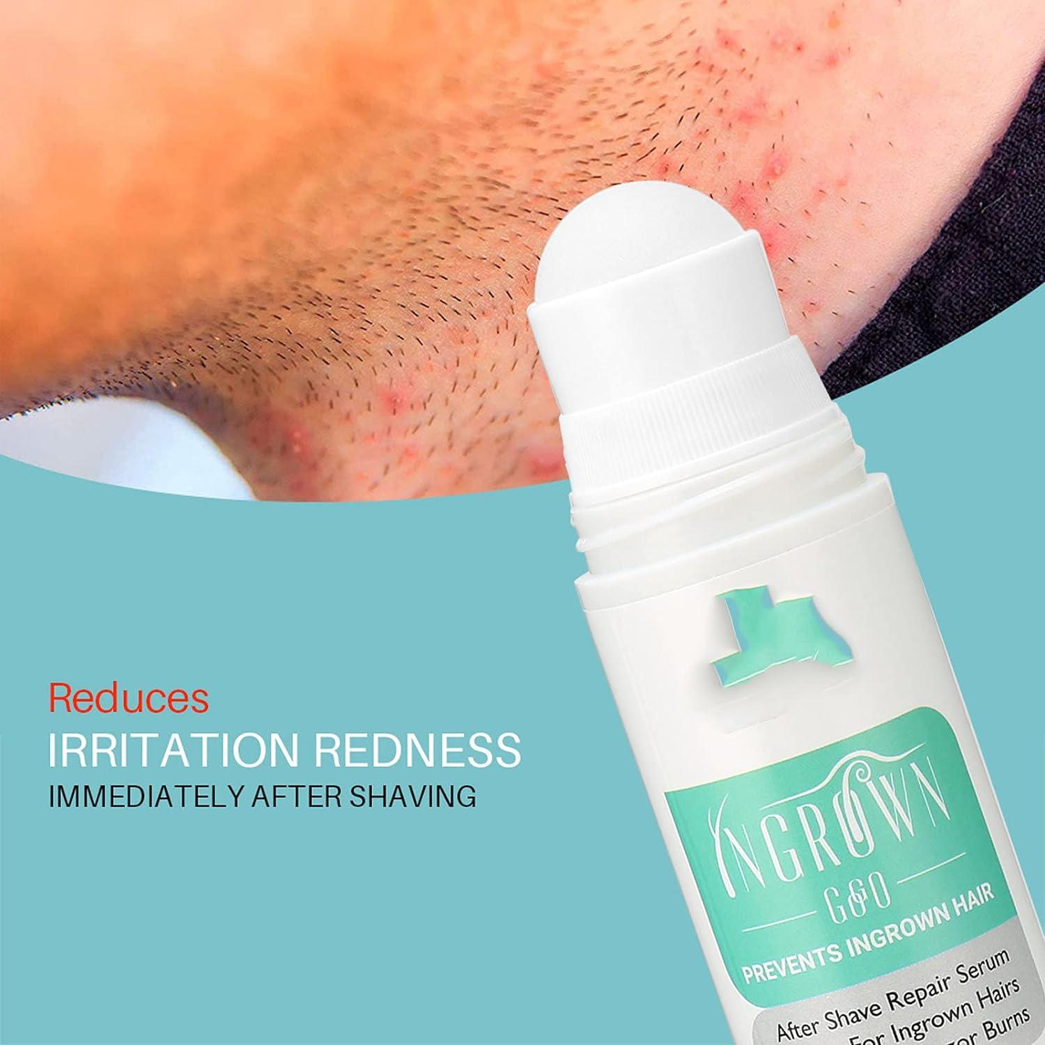 Razor Bumps Solution: 100ml Roll-on After Shave Repair Serum for Men ...