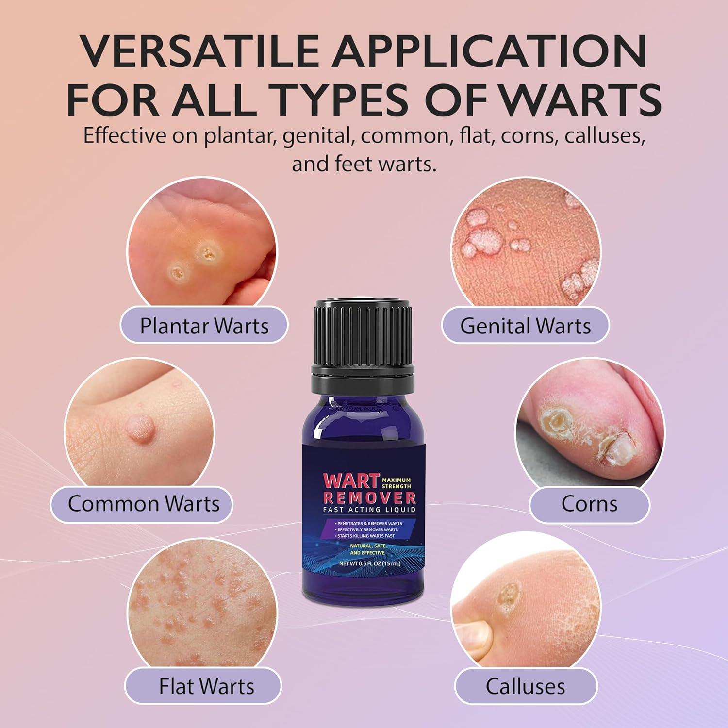 Fast-Acting Wart Remover for Plantar Warts - Salicylic Acid Freeze Off ...