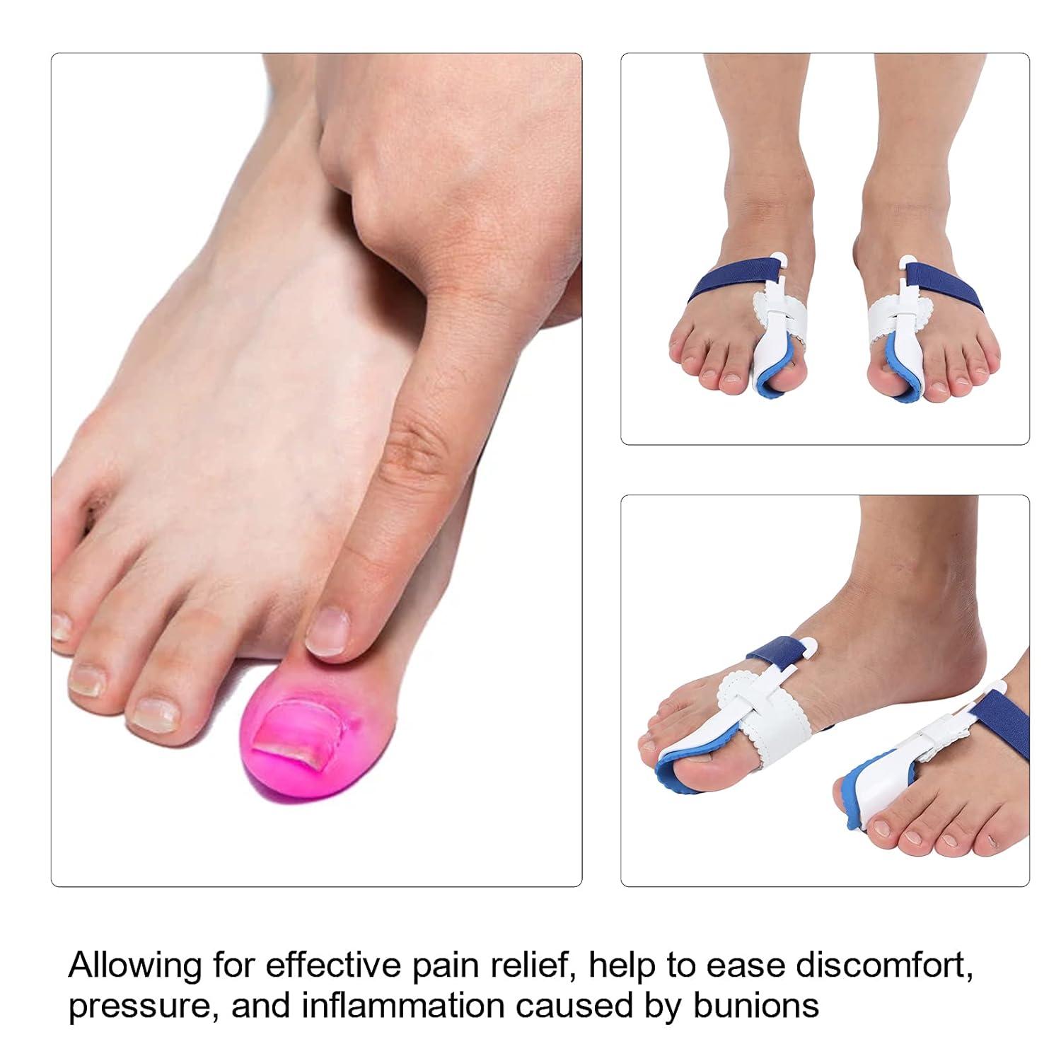 Bunion Valgus Corrector | Hallux Valgus Straightener for Men | Big Toe ...