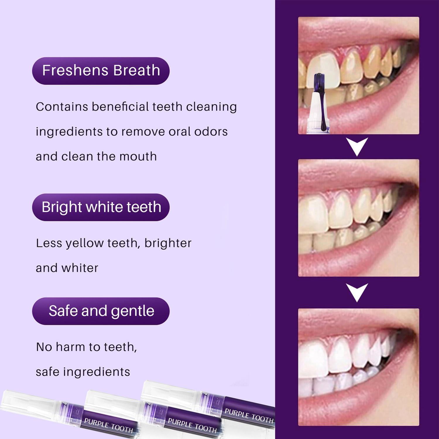 Tooth Whitening Pen Set - 3 Fast & Effective Bleaching Applications ...