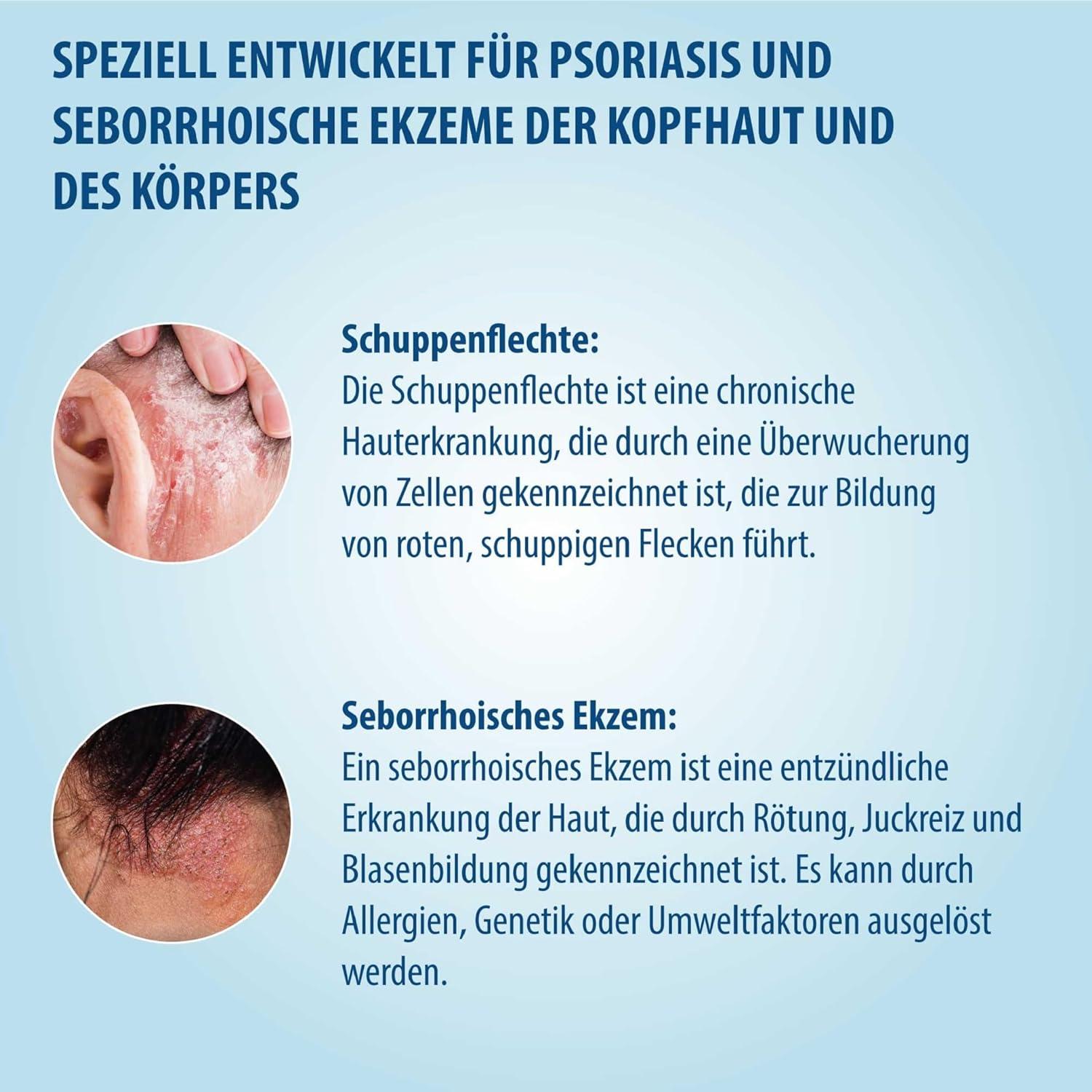 Evolsin Eczema & Psoriasis Shampoo | Cortisone-Free Treatment for Scalp ...