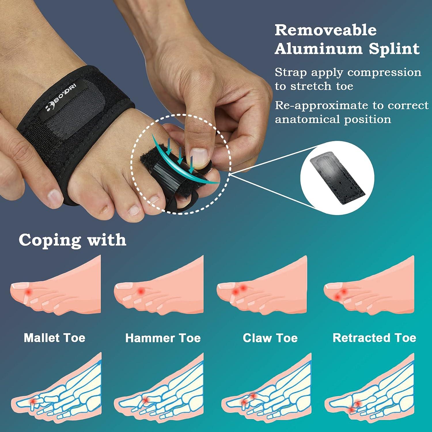 Boydri Toe Rigid Splint Stabilizers - Toe Straightener for Broken Toe ...