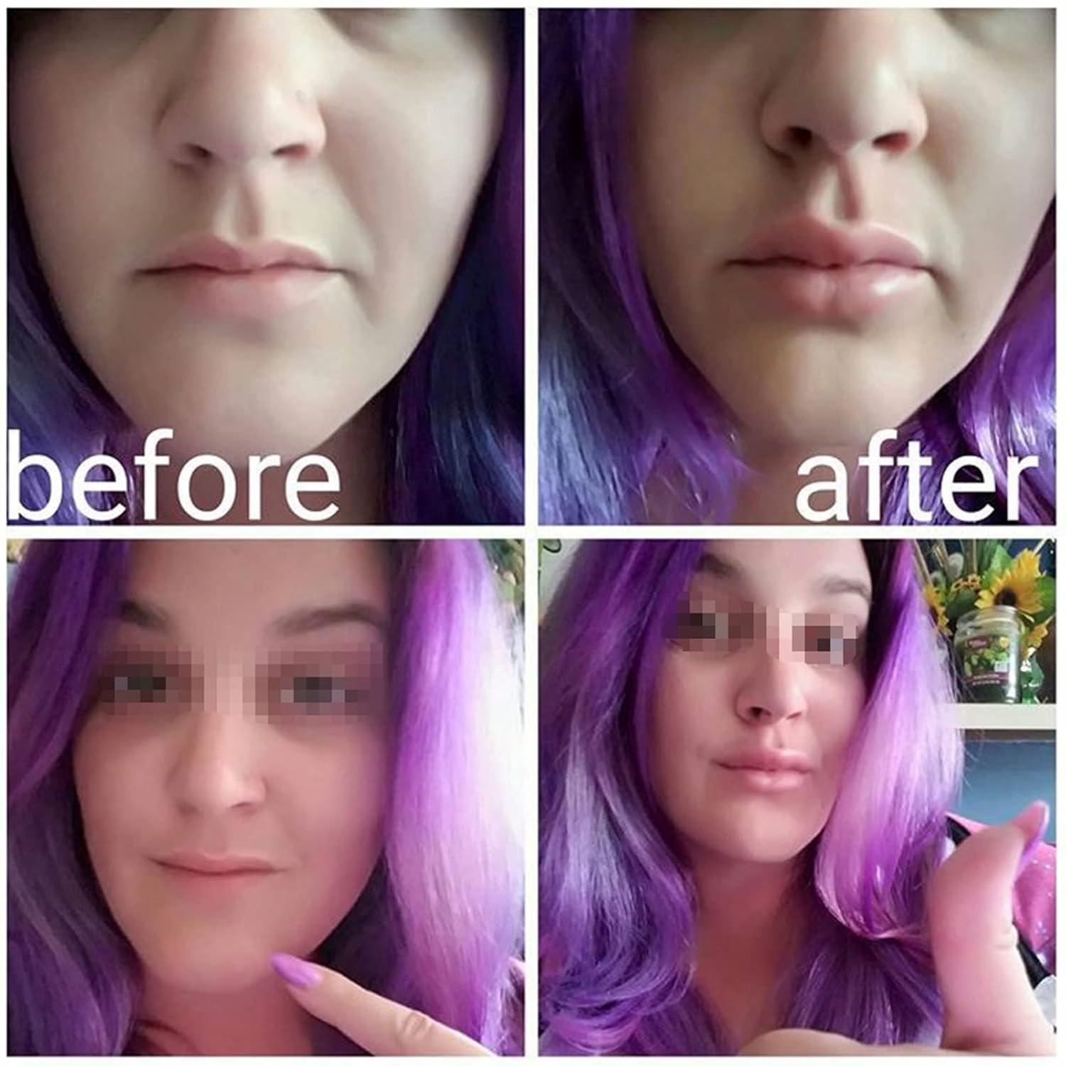 Fish Shaped Lip Plumper Enhancer | Achieve Thicker Pouty Lips with Hand ...