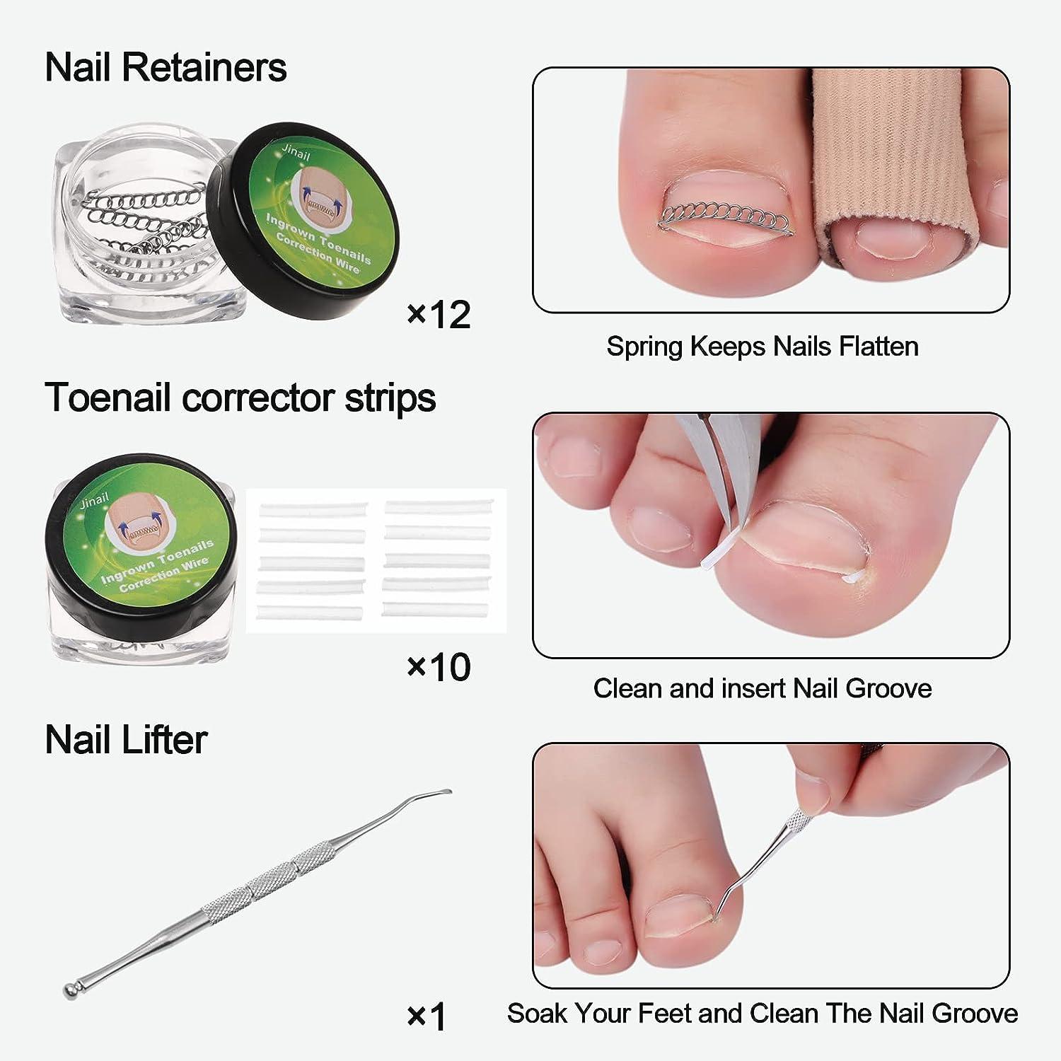 Ingrown Toenail Treatment Kit | Toe Nail Correction Tool Set with ...