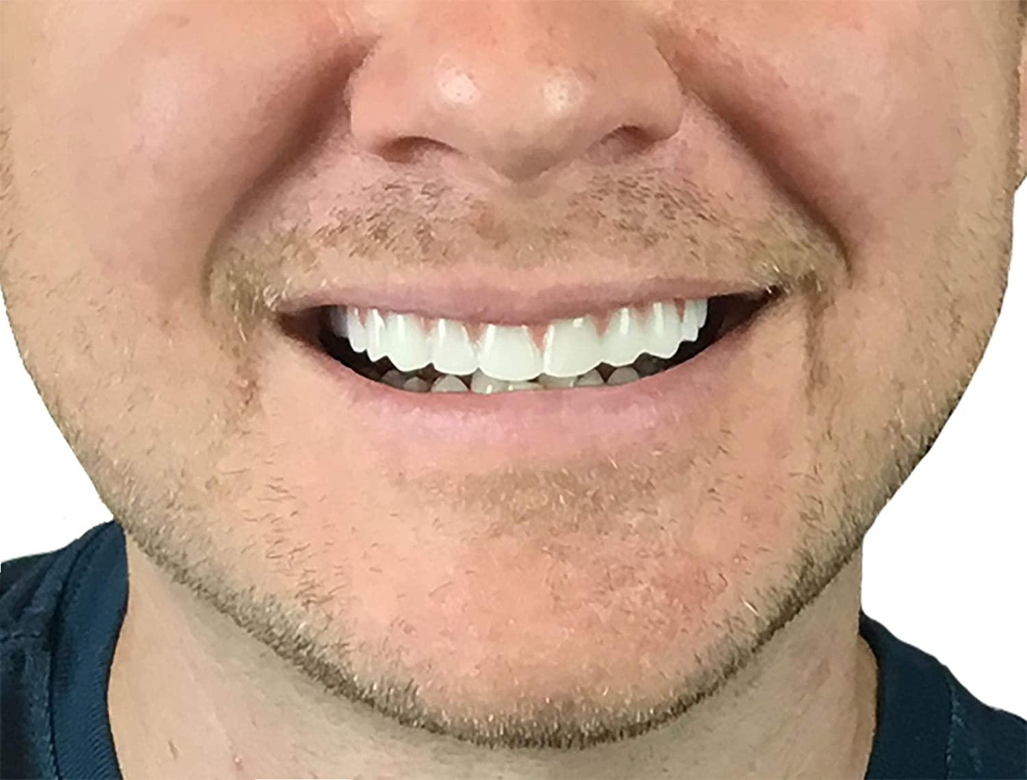 Instant Smile Comfort Fit Flex Upper Veneer - Natural Shade Cosmetic ...