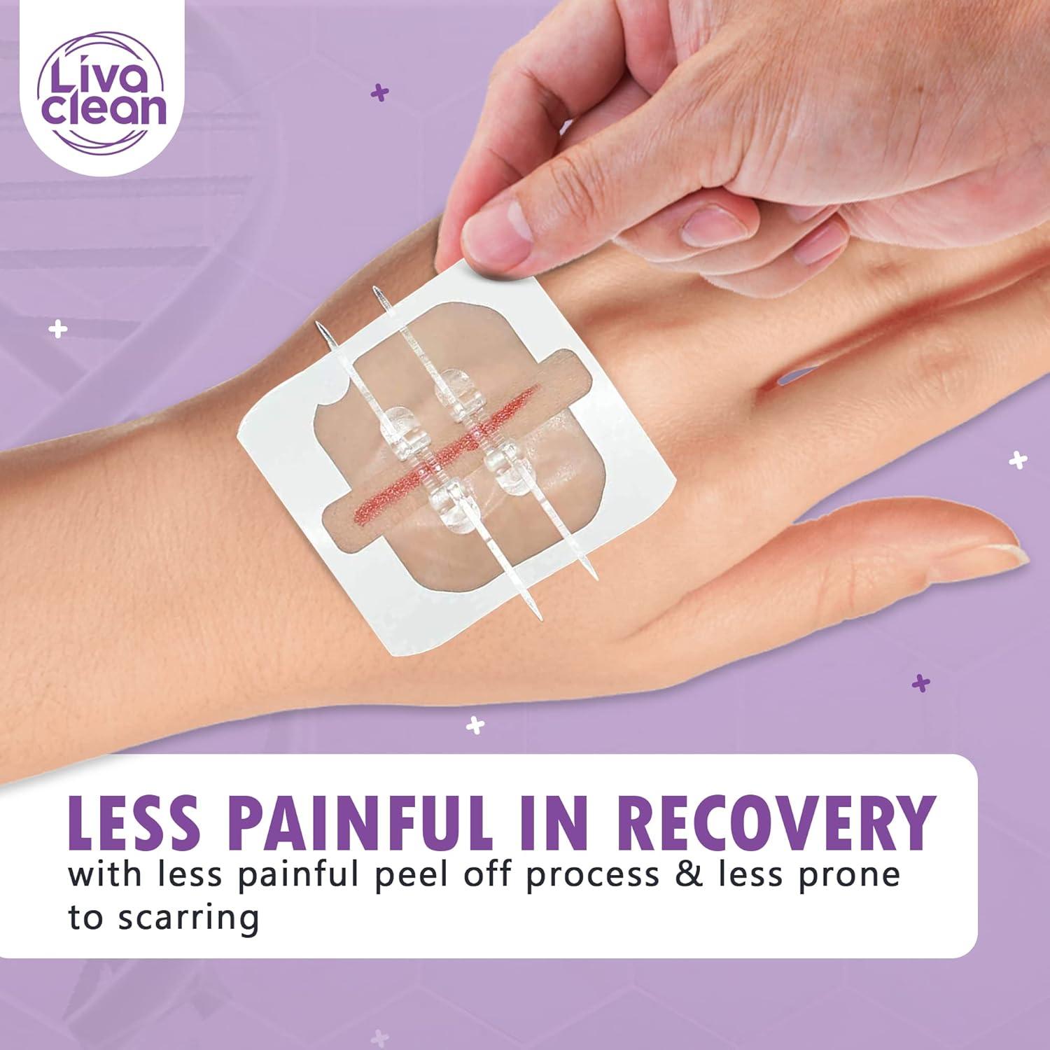 Wound Closure Strips Kit - 3 CT 2.3x2.3 Zip Stitch & Adhesive Steri ...