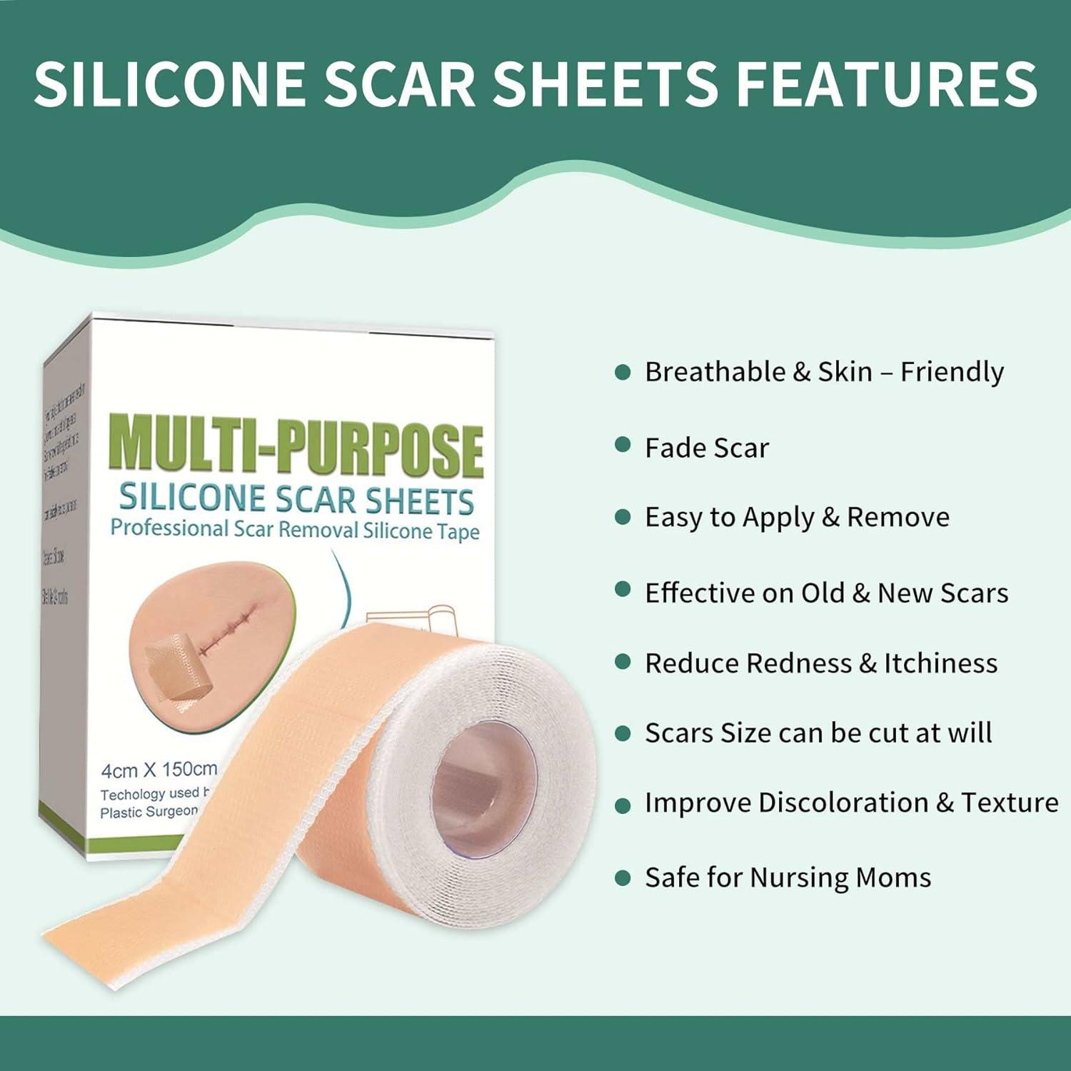 Medical Grade Silicone Scar Sheets (1.57 x 60) - Effective Scar Removal ...
