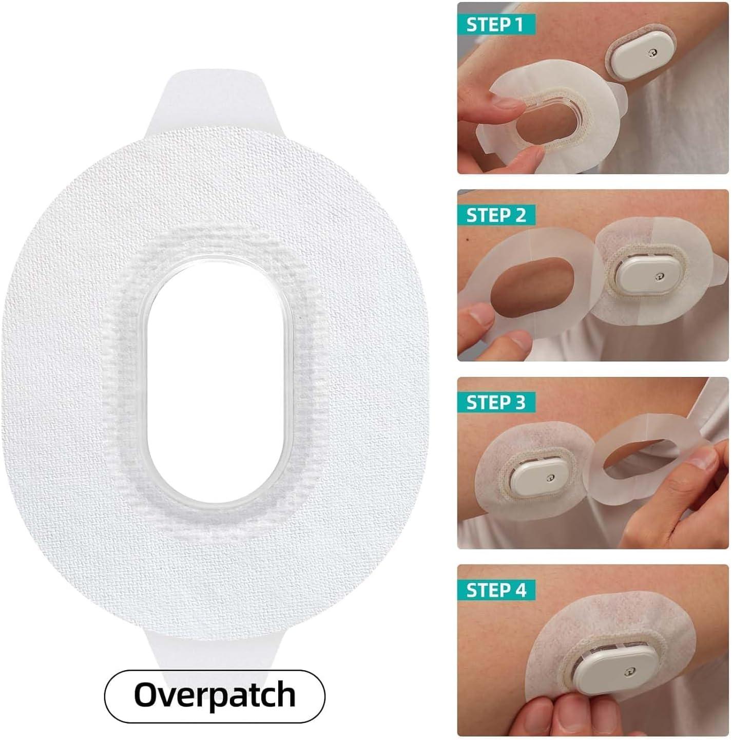 SIBIO KS1 Continuous Ketone Monitoring (CKM) System English Version for ...