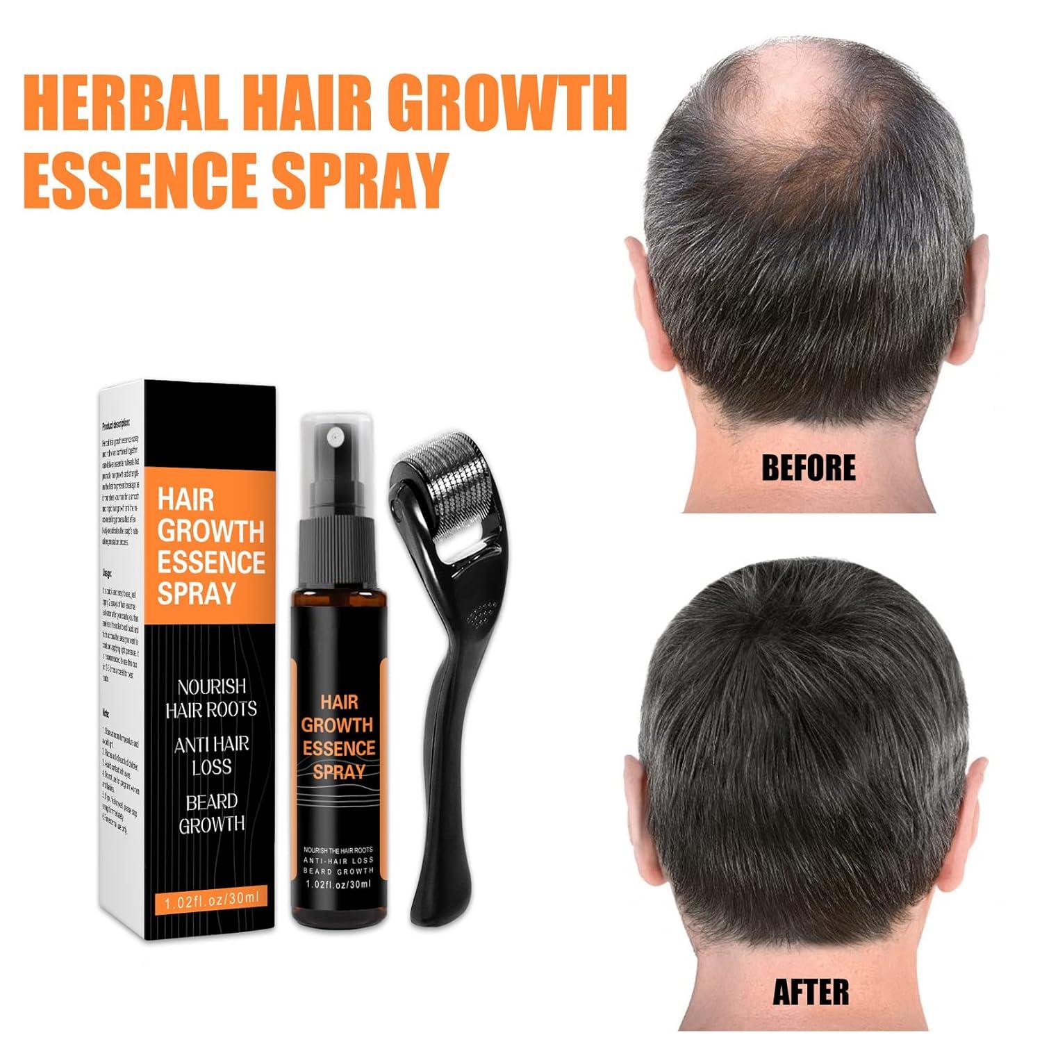 Bio'tech Advanced Regrowth Treatment Kit | Hair Growth Serum Roller Set ...