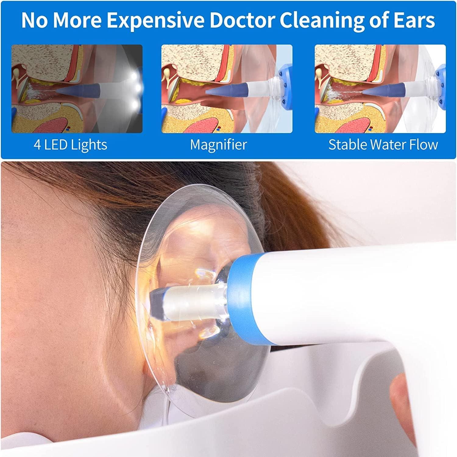 Rechargeable Electric Ear Wax Remover with 4 Pressure Levels and 5 ...