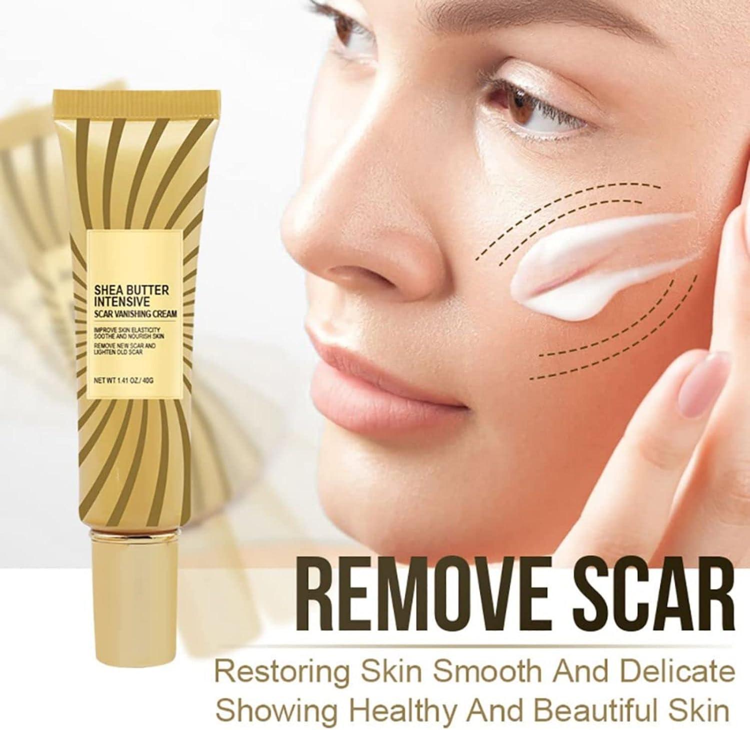 Yuemei Scar Vanishing Cream - Strengthen Skin Repair, Remove Old Scars ...