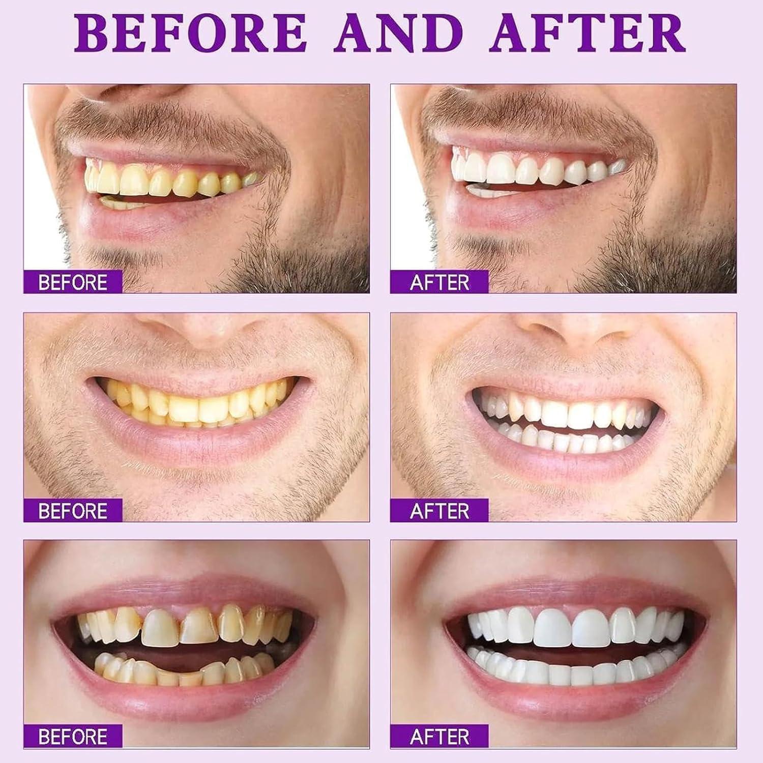 SP-7 Probiotic Lightening Toothpaste | Brightening Fresh Breath & Spot ...